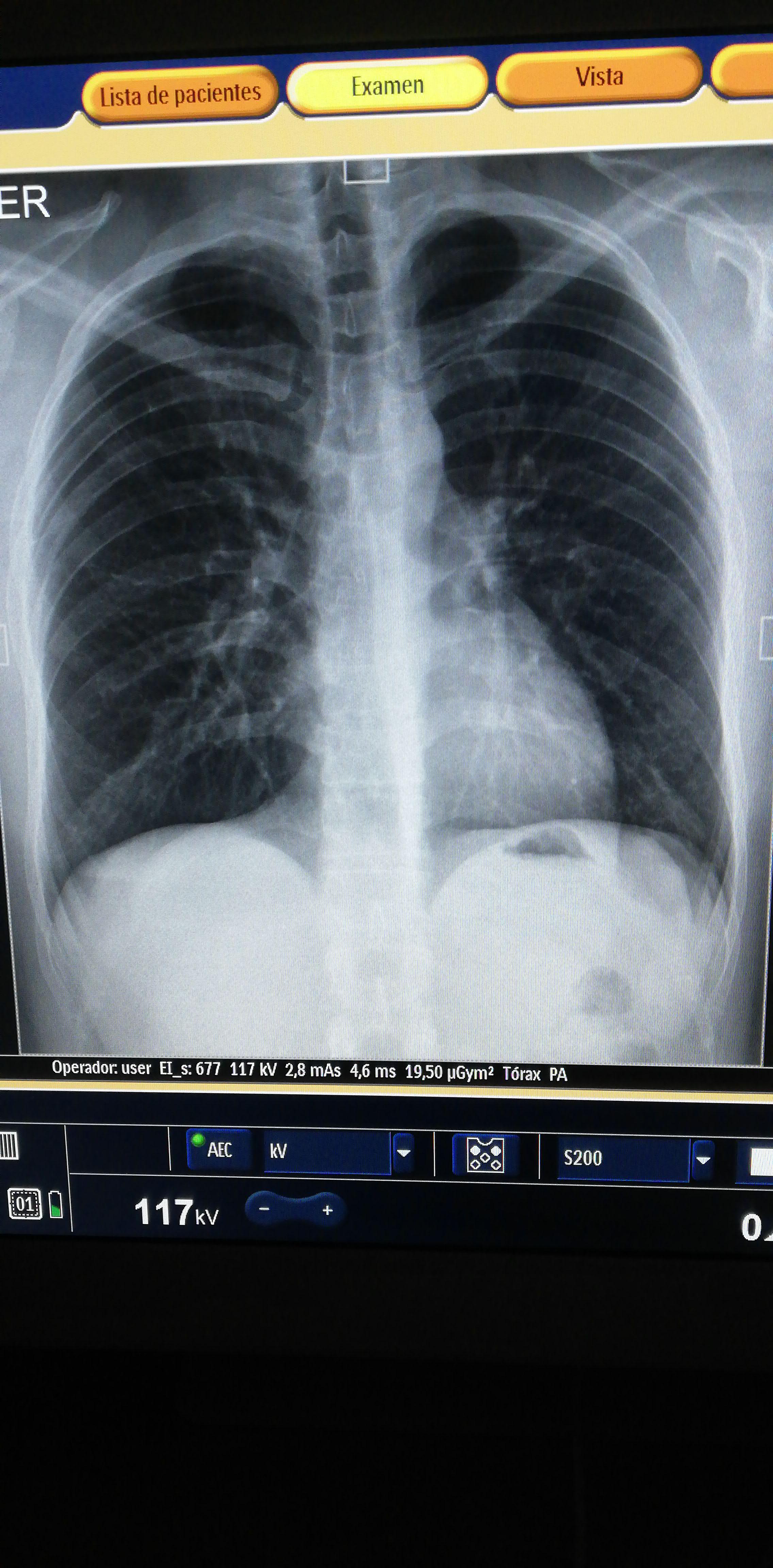 Third year of vaping, lungs are still clean. | Scrolller