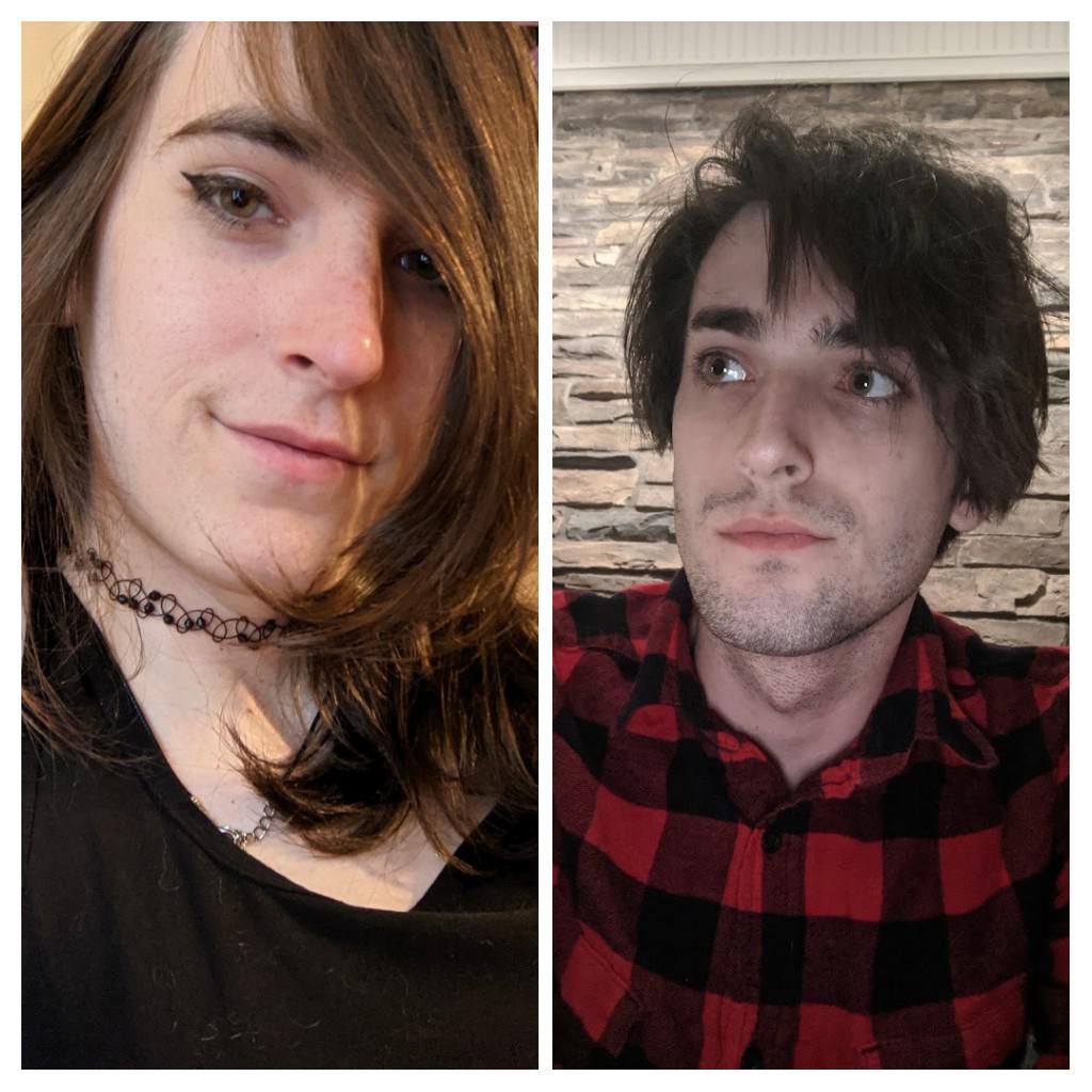 This estrogen stuff is amazing. 1 year vs -6 months mtf HRT at 25 years ...