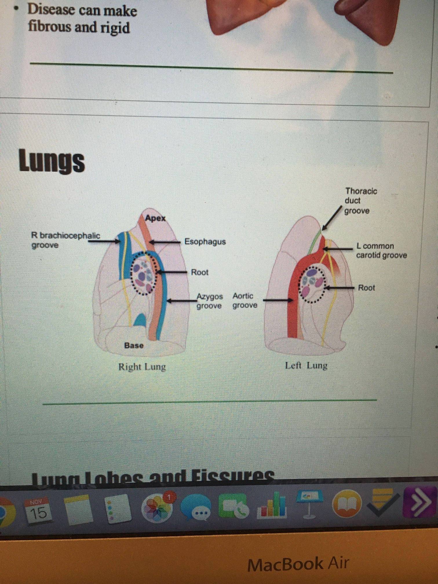 This has to be the worst diagram to use to try and orient yourself to the lungs | Scrolller