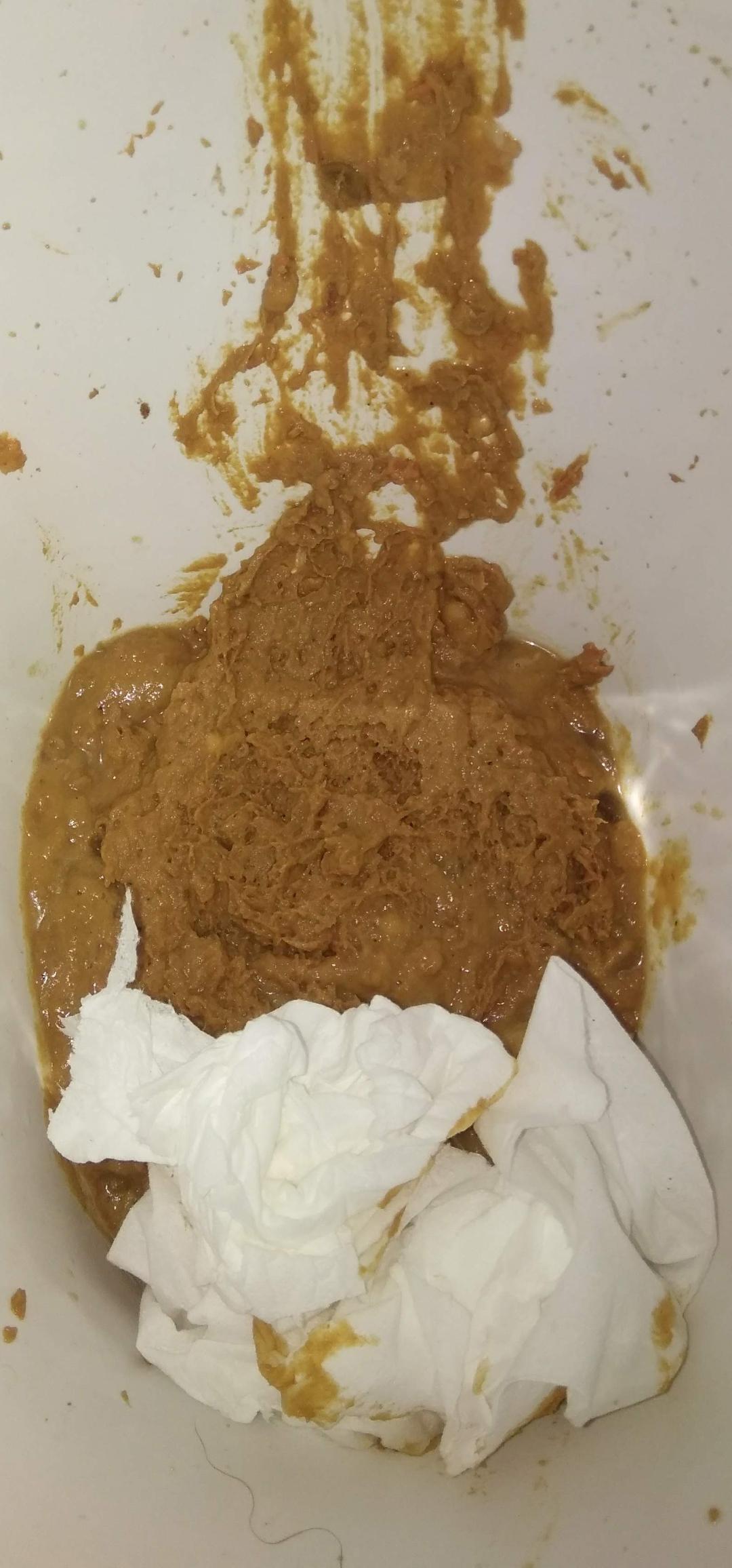 This is a normal shit for me, it's not that bad is it? | Scrolller