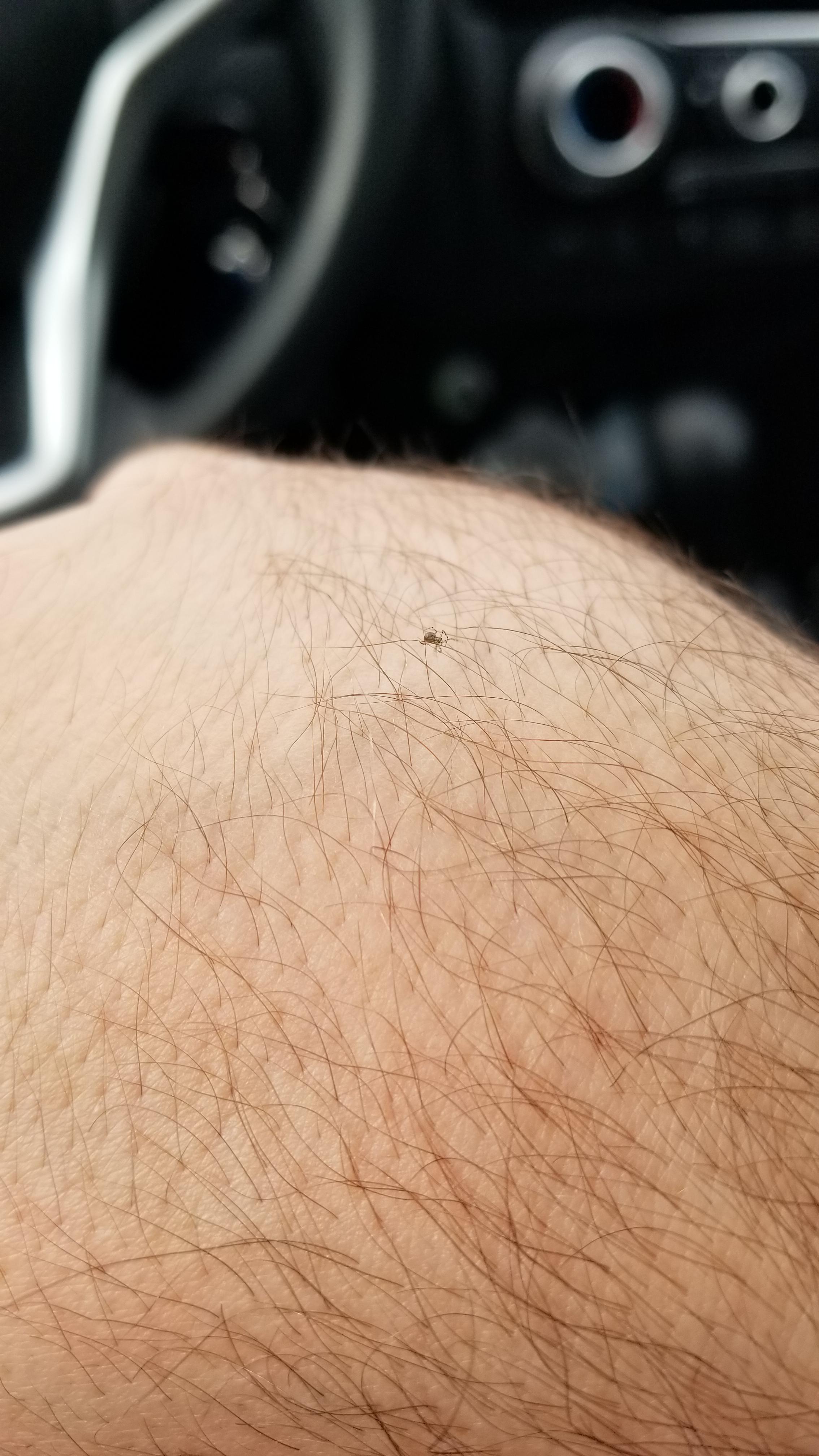 Tiny baby spider | Scrolller