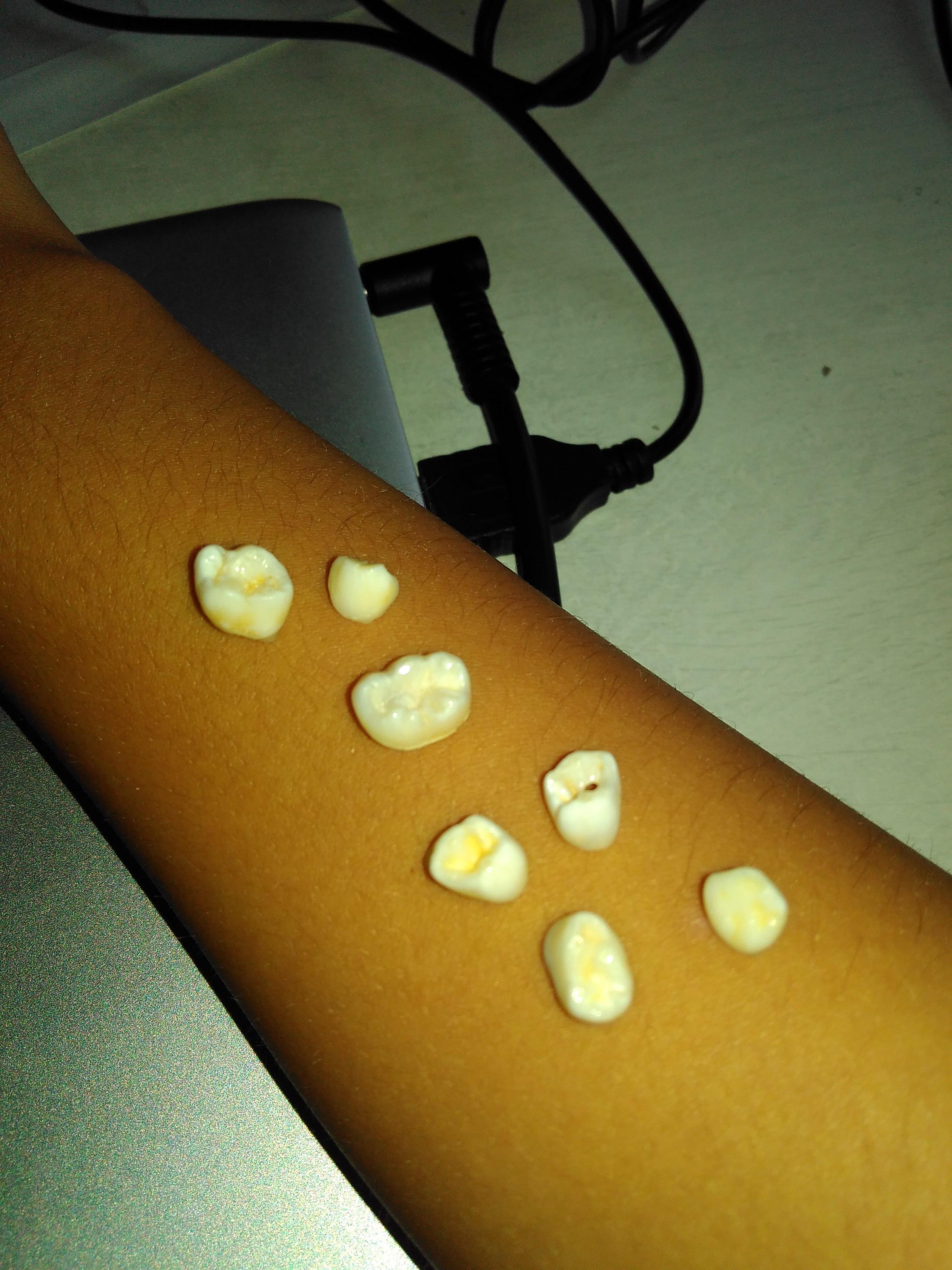 uncomfortable_arm | Scrolller