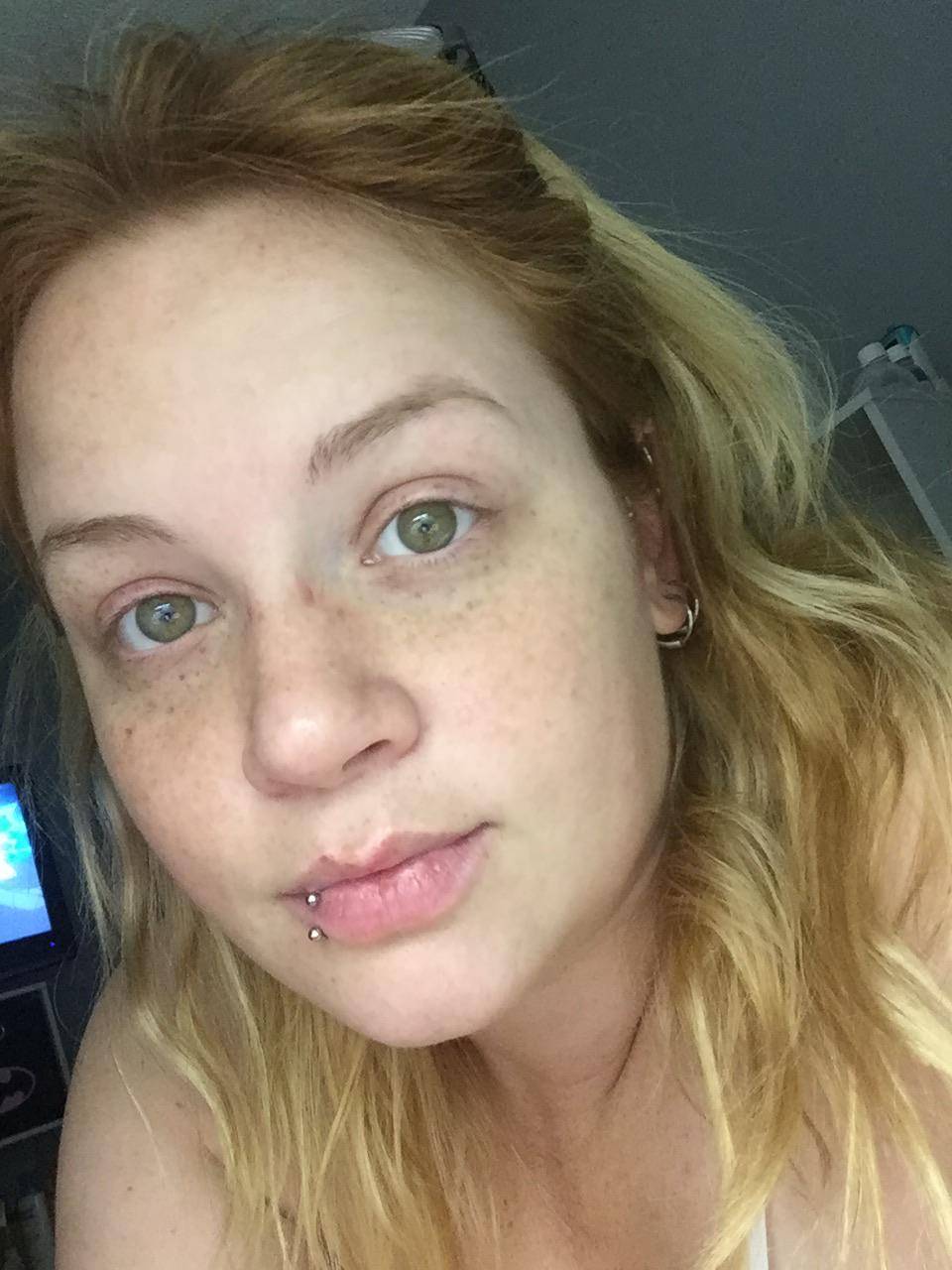 Very tired green eyes. | Scrolller