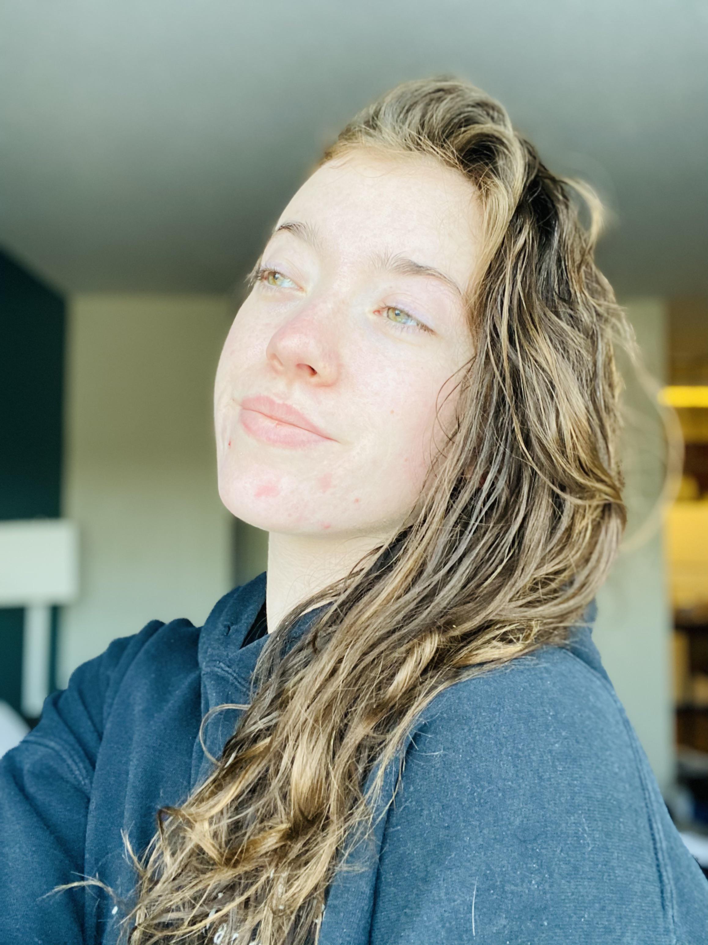 Wearing less makeup has been helping my skin improve! [over 18] | Scrolller