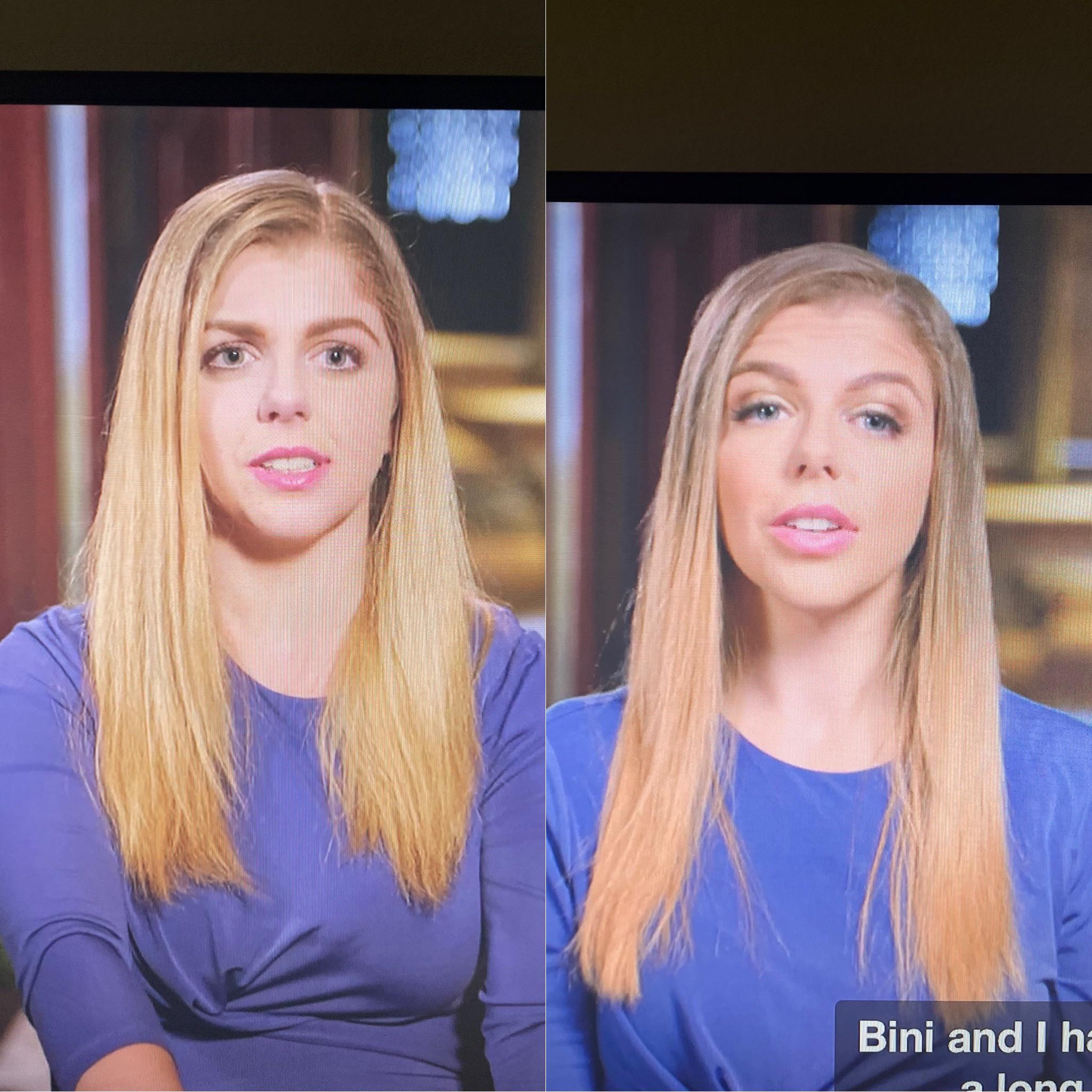 When they have you wear the same outfit for continuity but the surgery don’t lie. | Scrolller