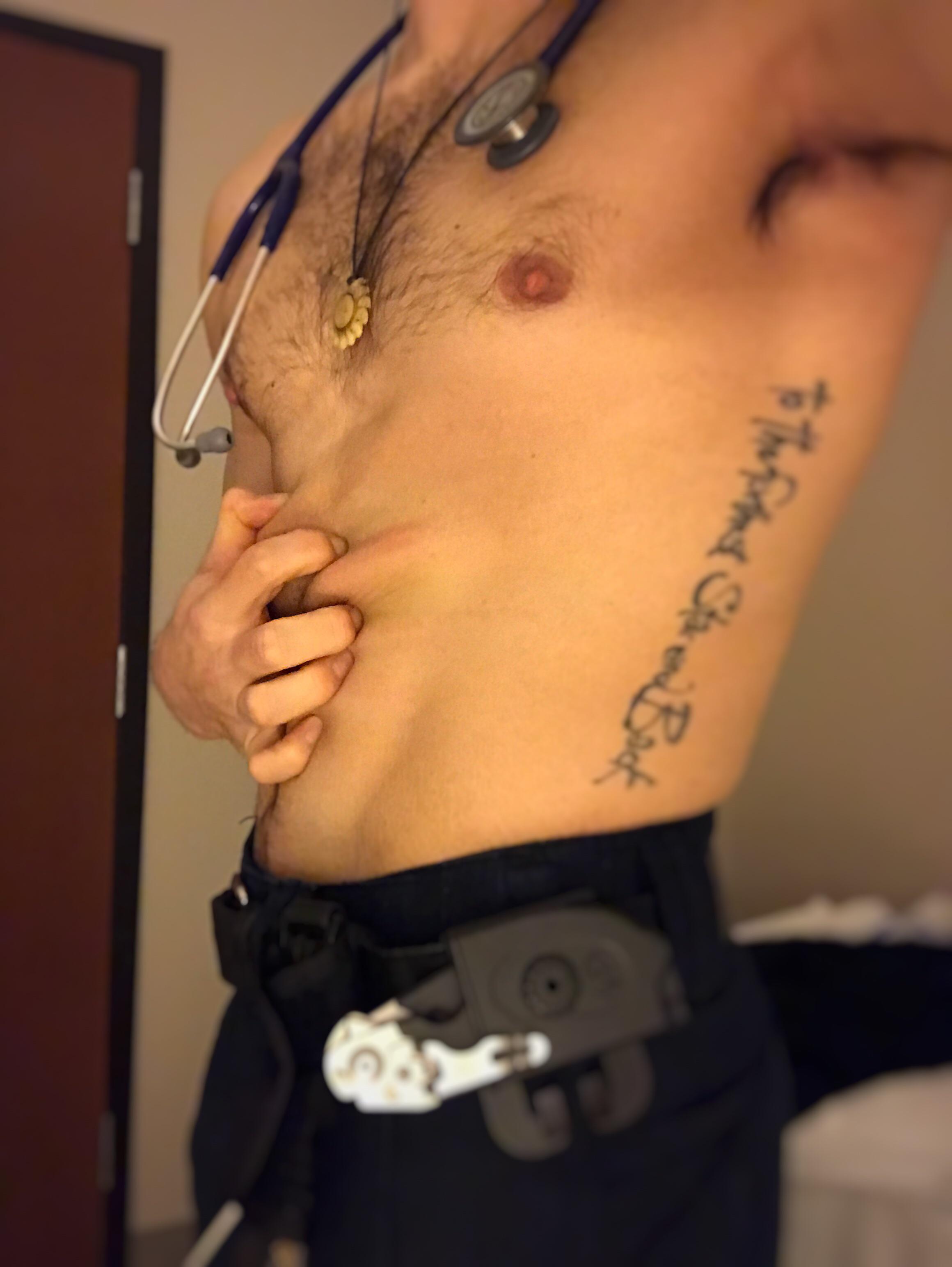 Who likes a little biting and scratching? | Scrolller