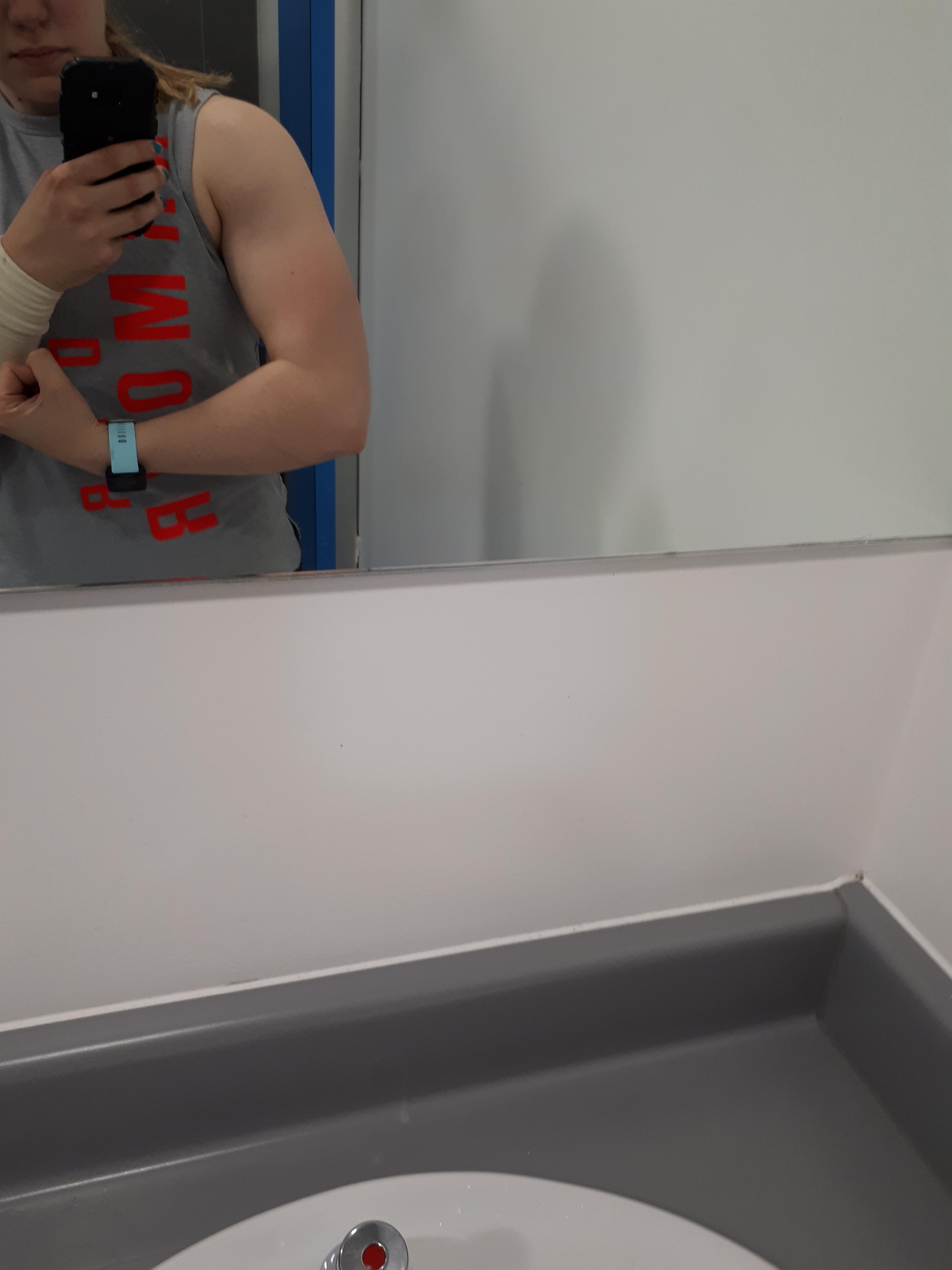 Will I ever post anything other than arm pics? | Scrolller