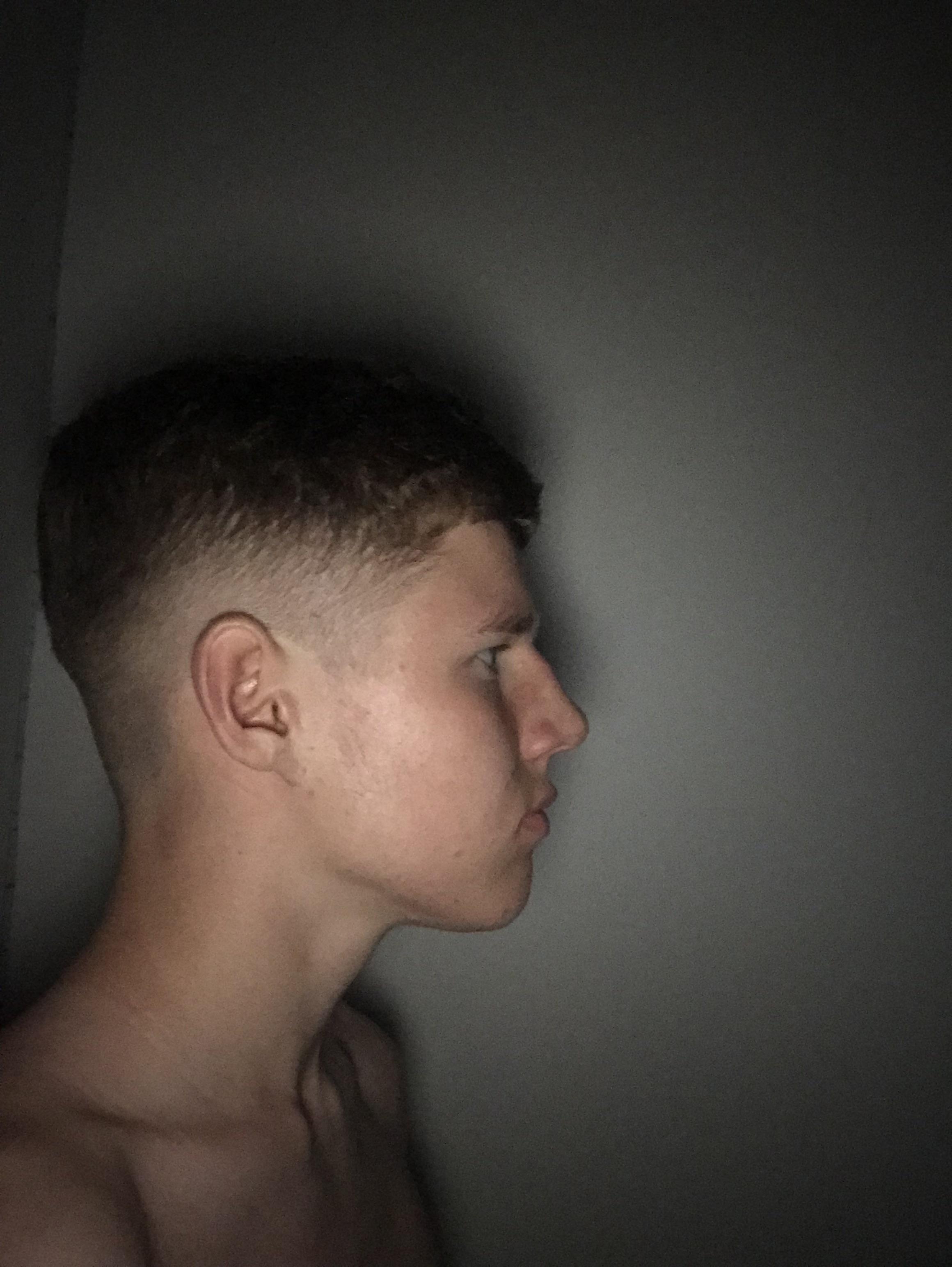 Will mewing make my face go forward ive just turned 15. | Scrolller