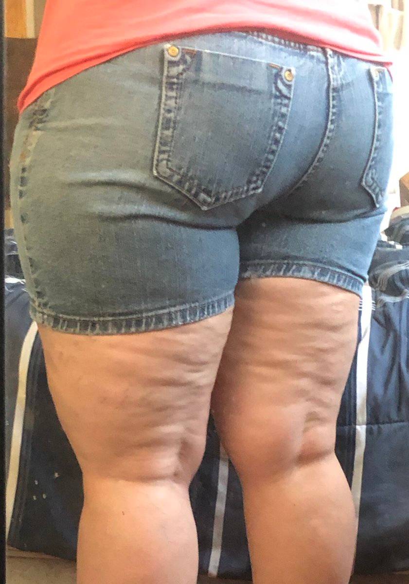 Woman In Short Jean Pants Has Cellulite On Her Thighs | Scrolller
