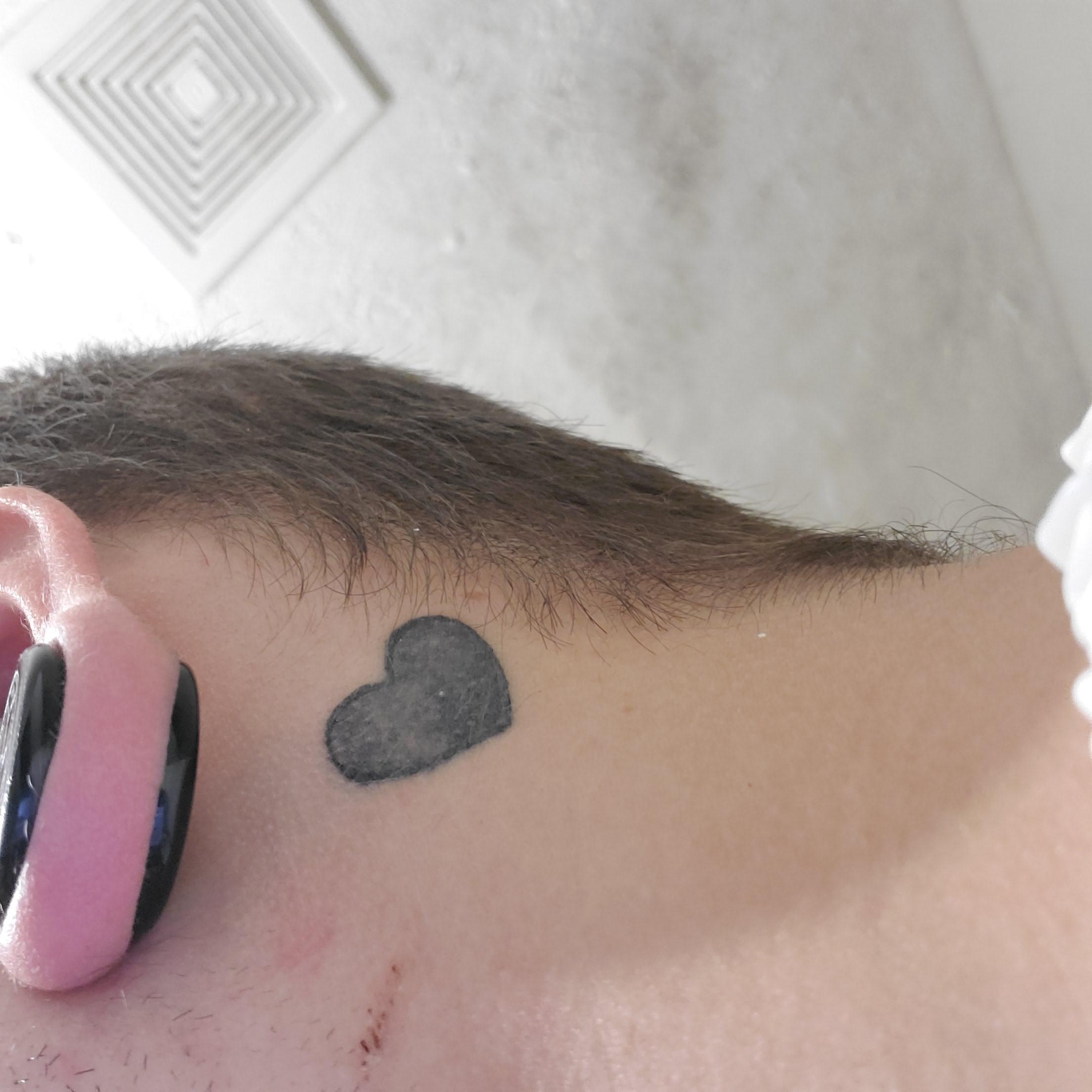 Wondering if my ear lobes look healthy at 7/8 | Scrolller Wondering if my ear lobes look healthy at 7/8 | Scrolller