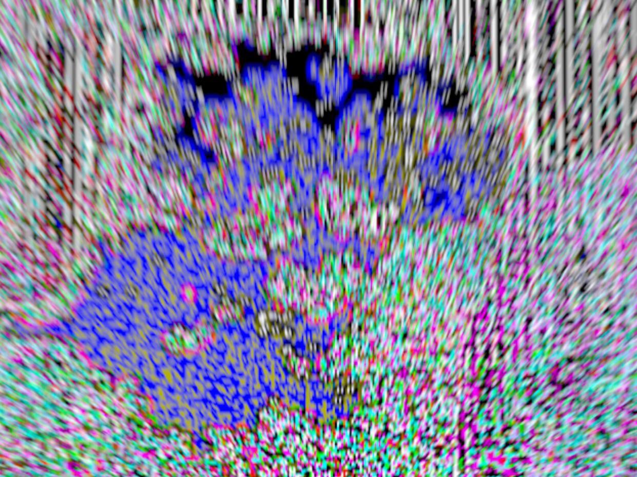 You’re eyelids. They’re mine now. | Scrolller