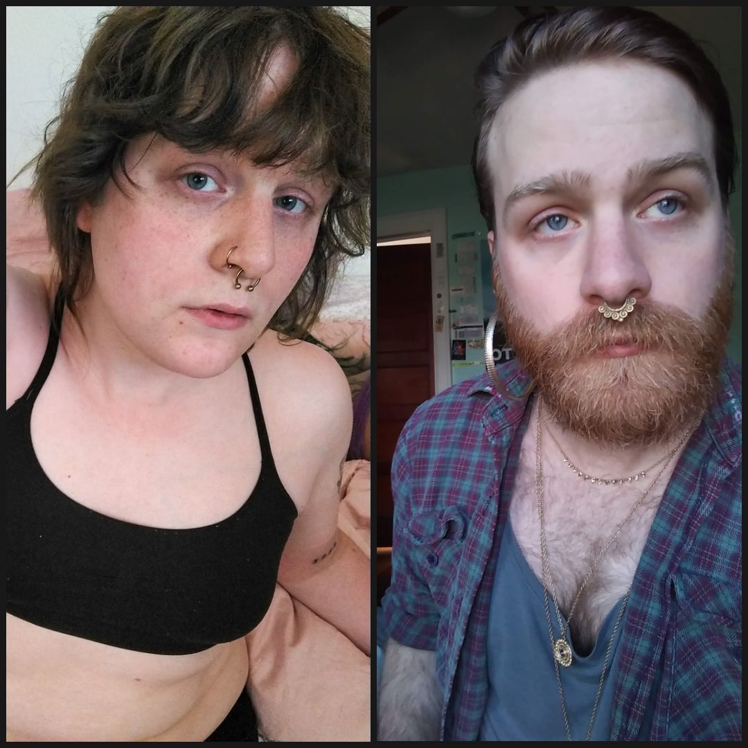 1.5 years HRT and -2 years HRT (2021 vs 2017) | Scrolller