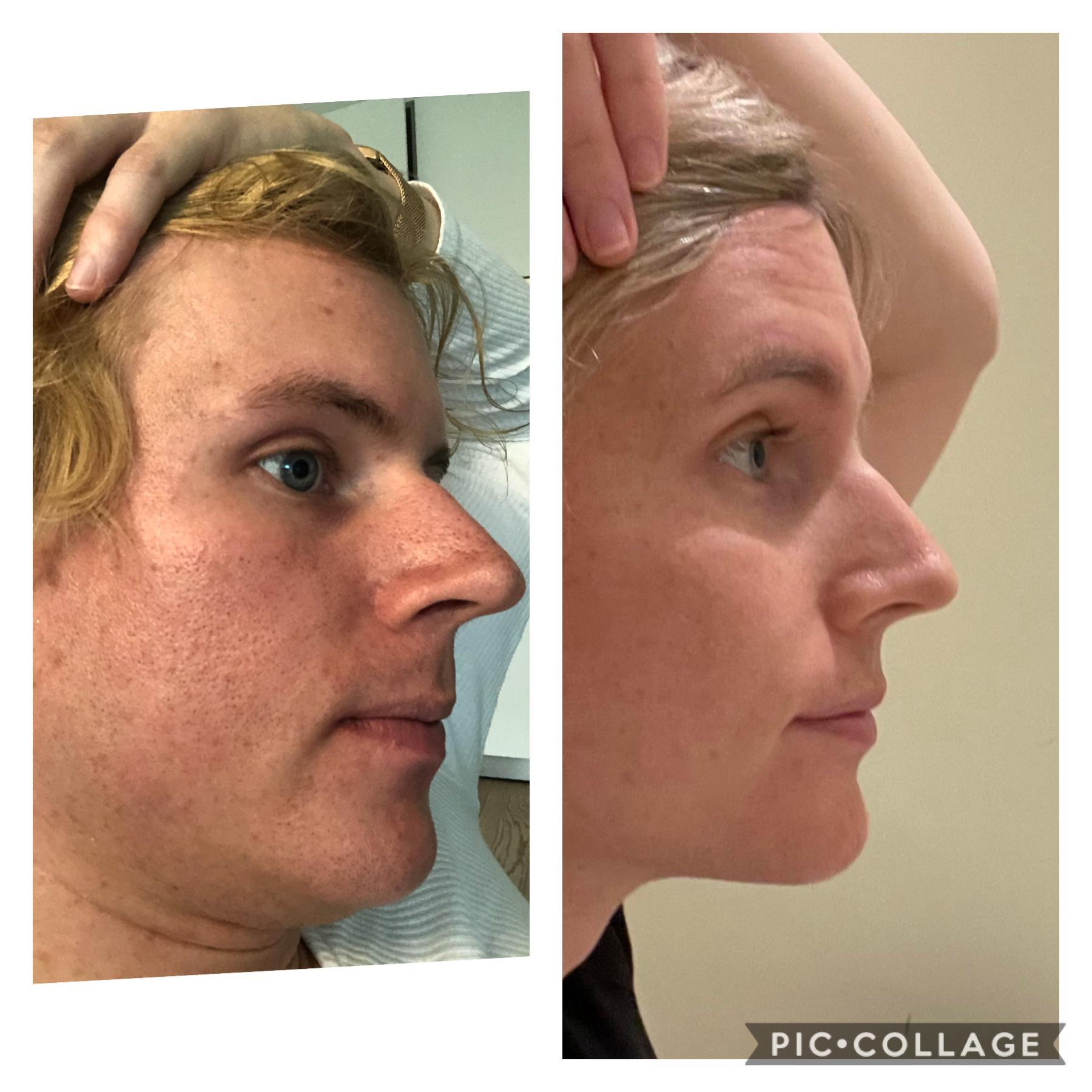 11 months of change😳 | Scrolller