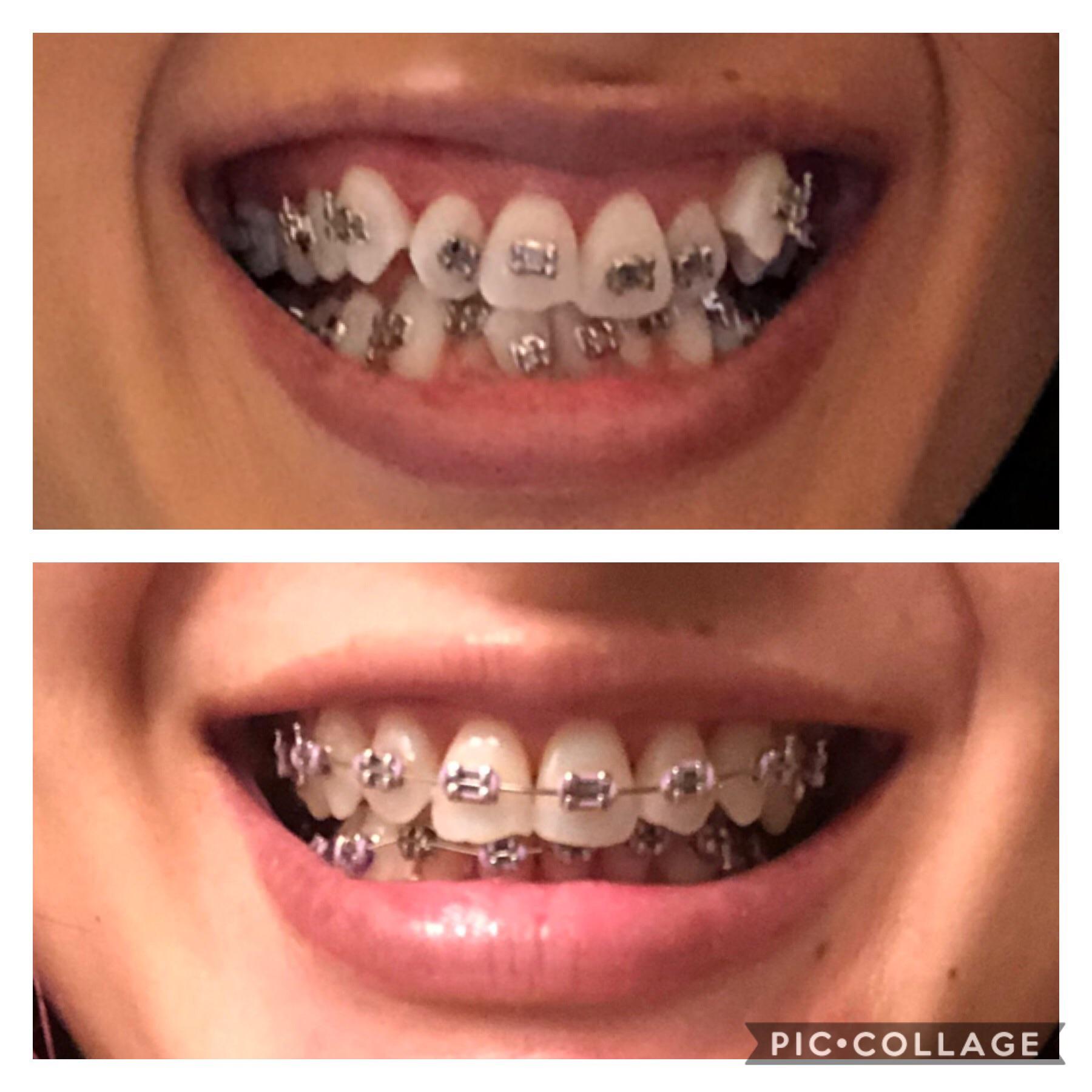 1st day - 5 months | Scrolller