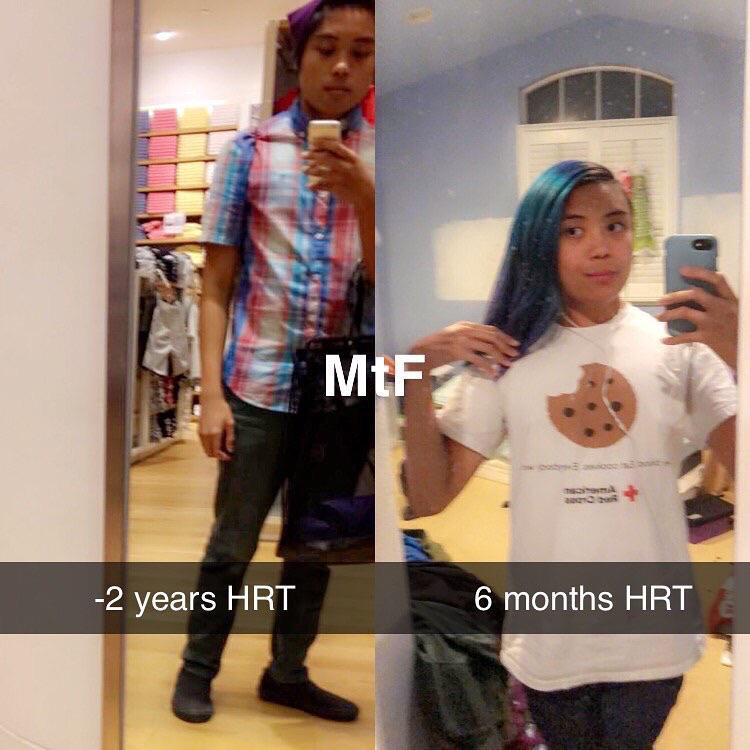 20 MtF 6 months HRT | Scrolller