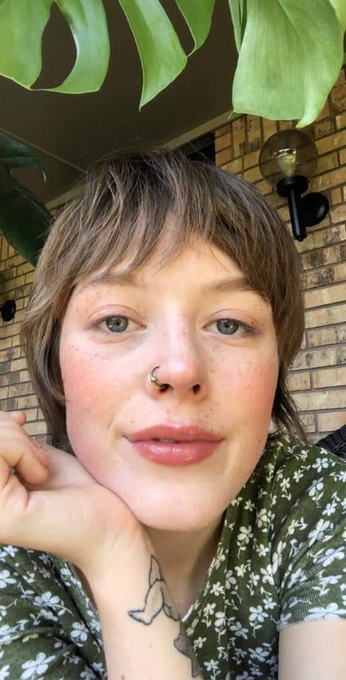 21F showing my spots | Scrolller