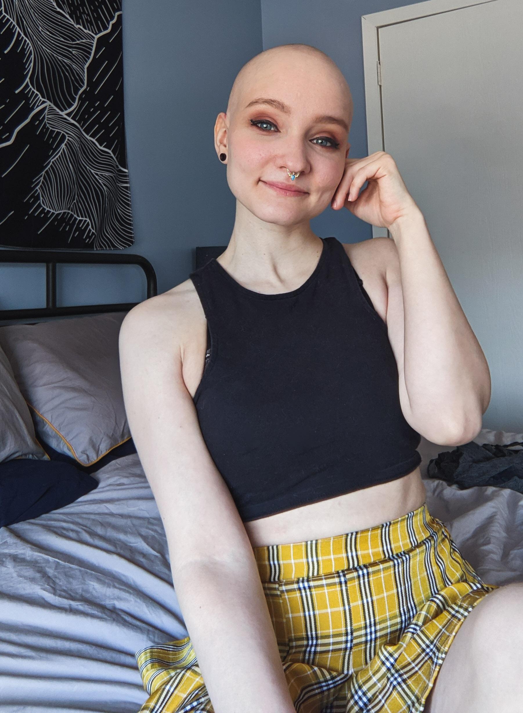 (24/F) fuck beauty standards, bald is beautiful 😘 | Scrolller