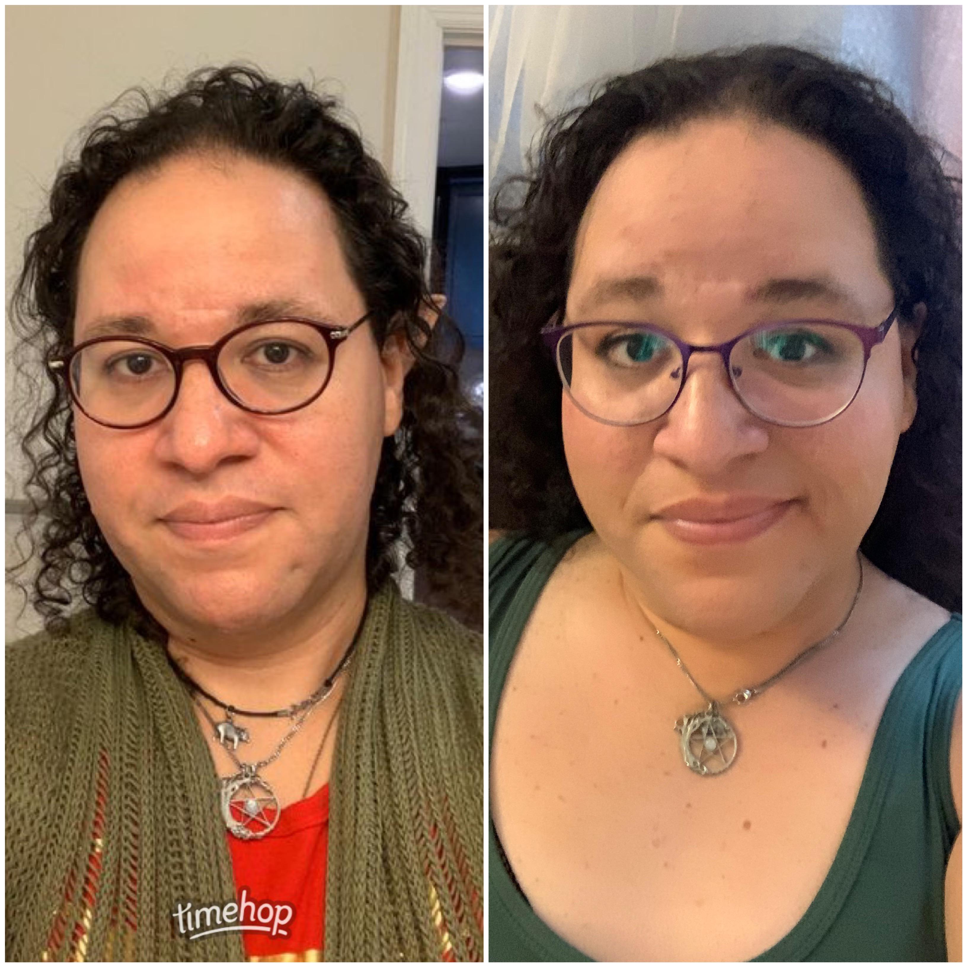 3 months HRT vs 15 months HRT | Scrolller