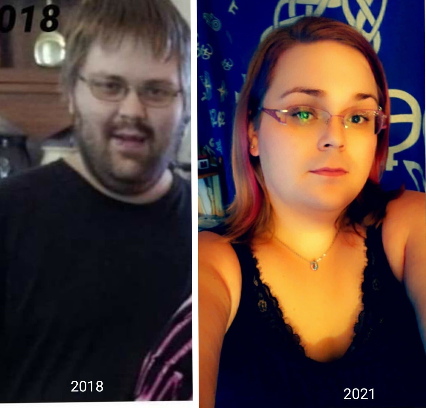 3 year difference 35y/o 1.5 years HRT | Scrolller