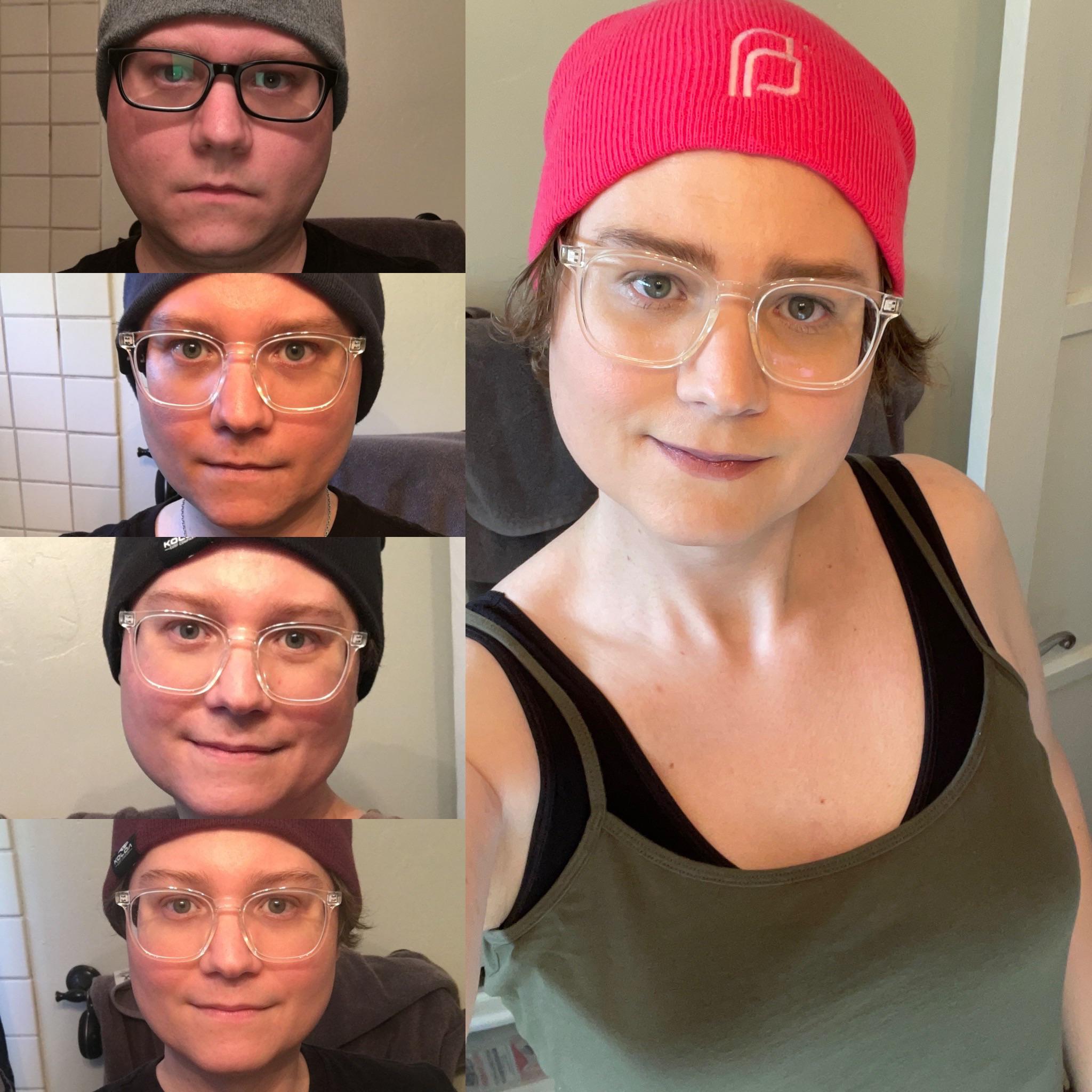 35 MTF, grateful for how far I’ve come (CCW: 1d, 4m, 7m, 9m, 11m) | Scrolller