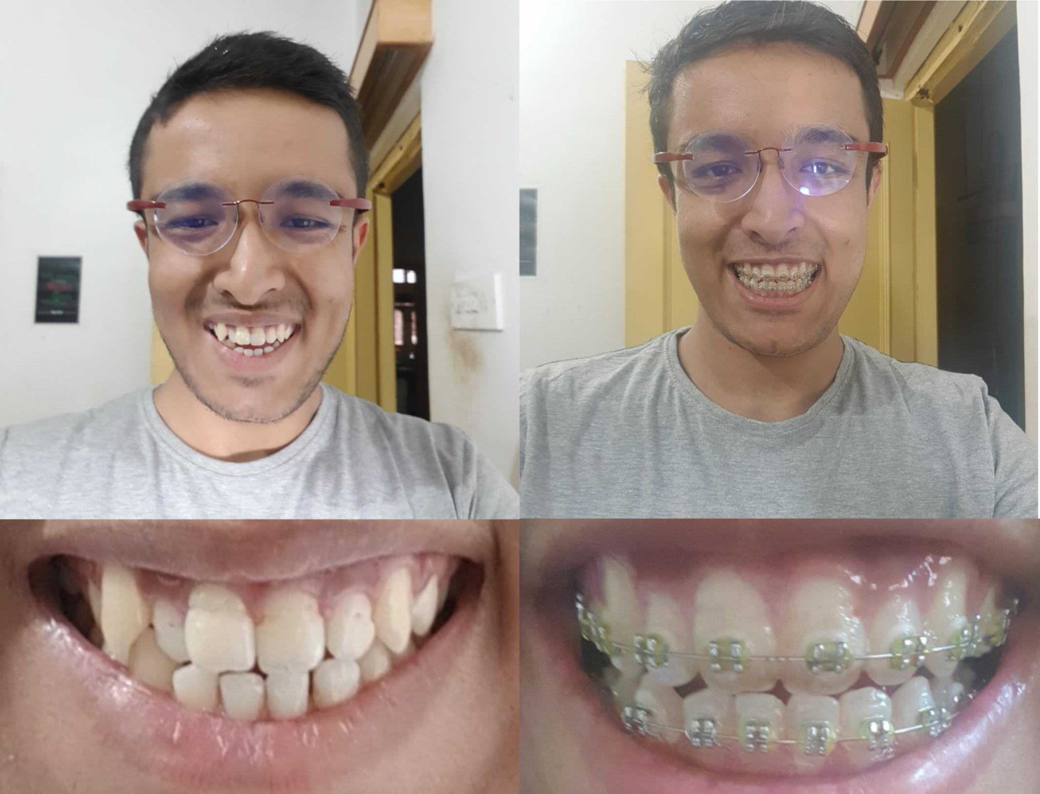 9 weeks progress. | Scrolller