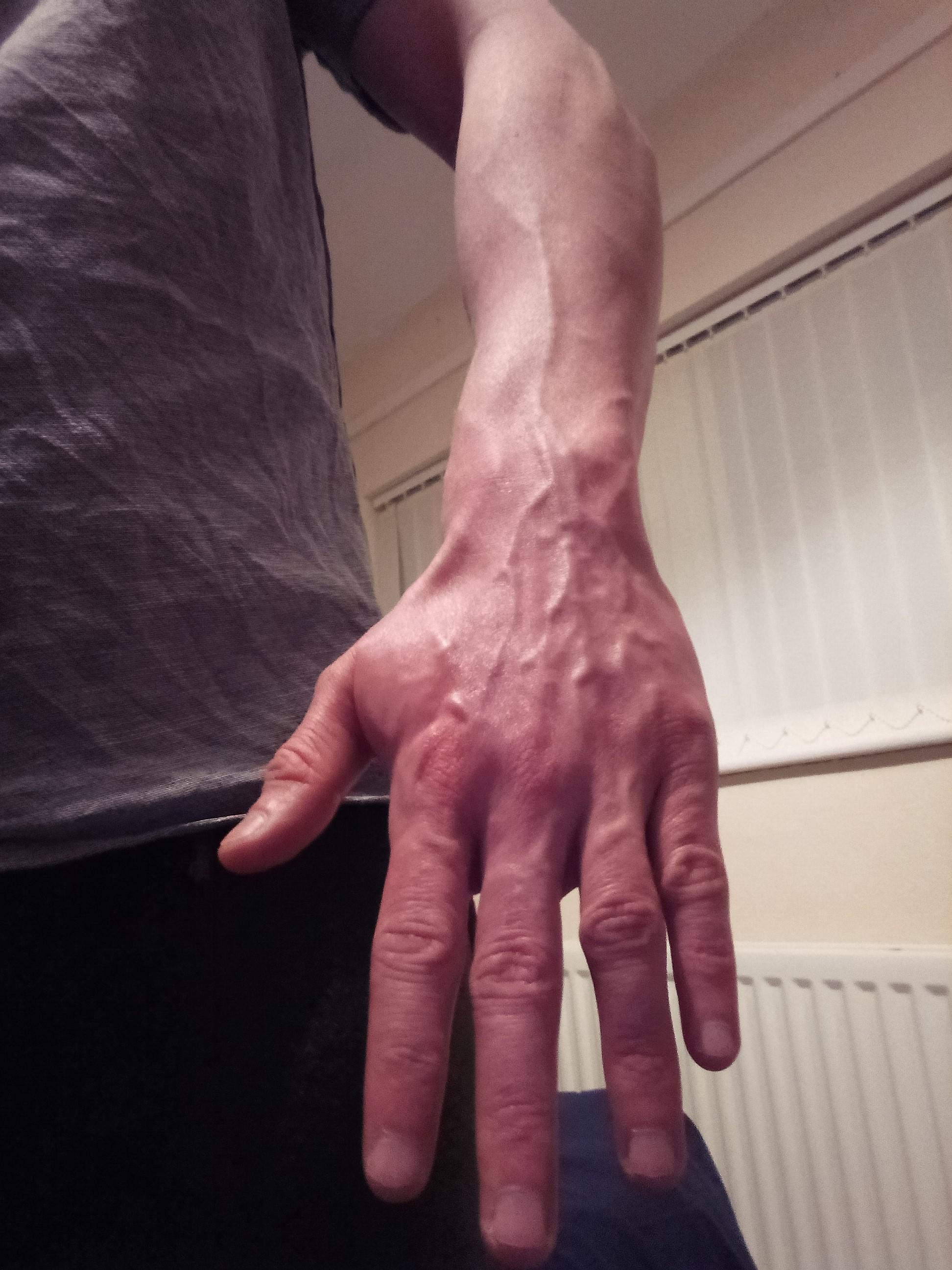 A few veins for you | Scrolller