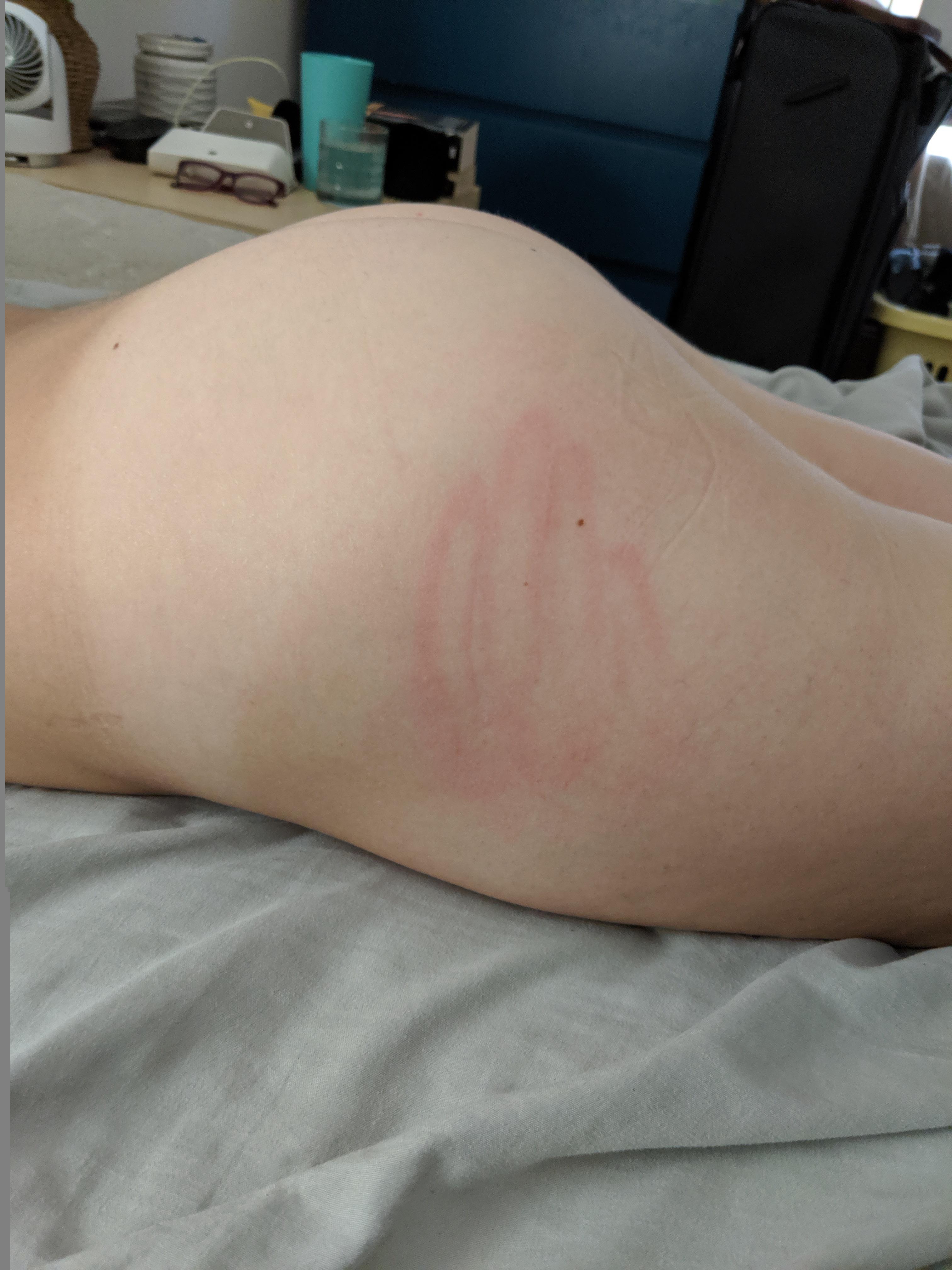 A perfect handprint | Scrolller