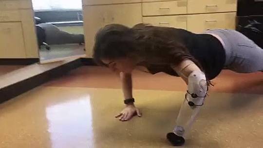 Angel Giuffria's arm. | Scrolller