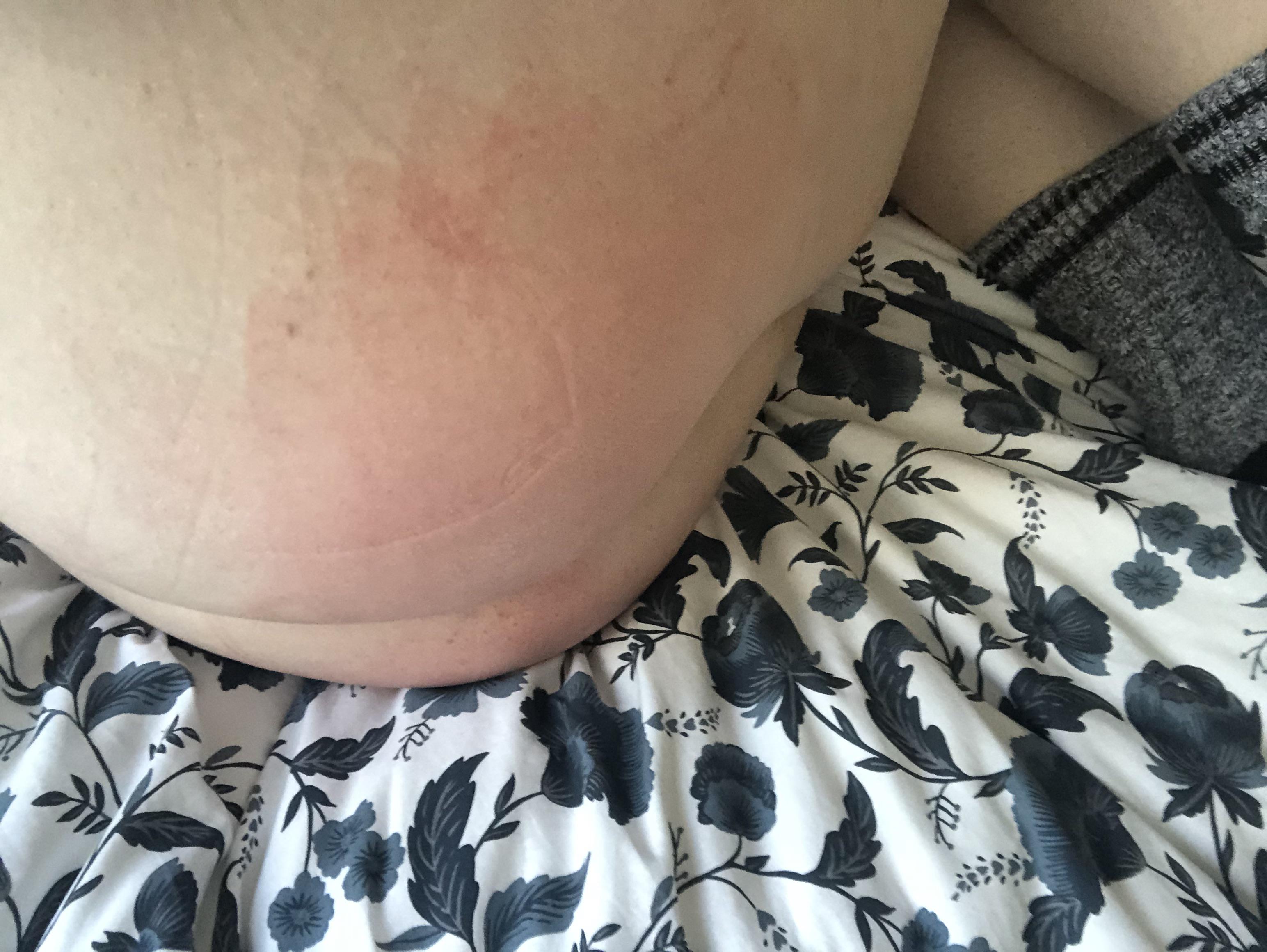 Another day, another photo of my red bum | Scrolller