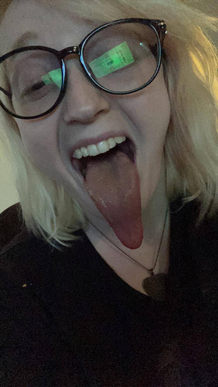 Attention seeking behavior | Scrolller