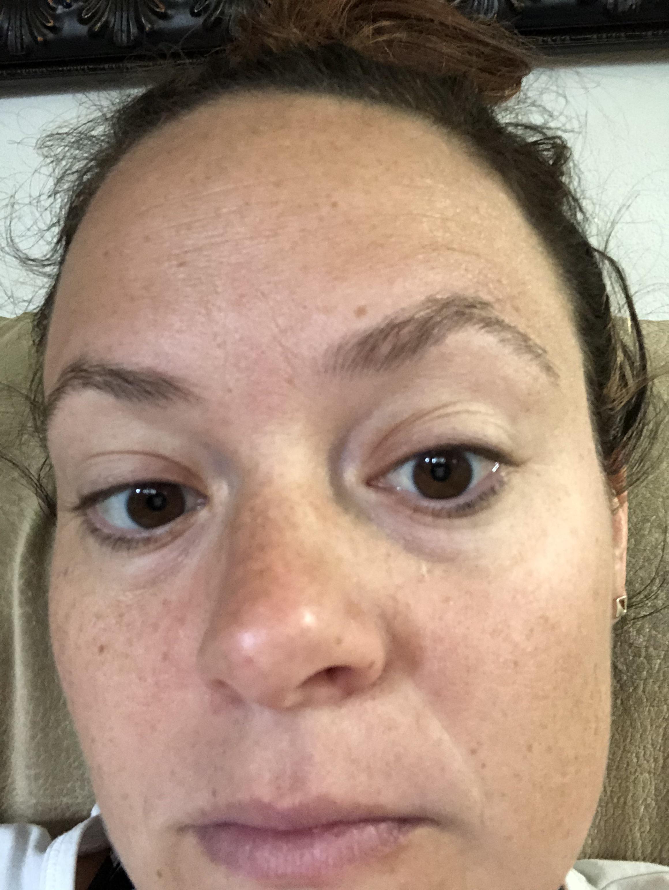 Bald spot from years of rubbing, will it ever fill in? | Scrolller