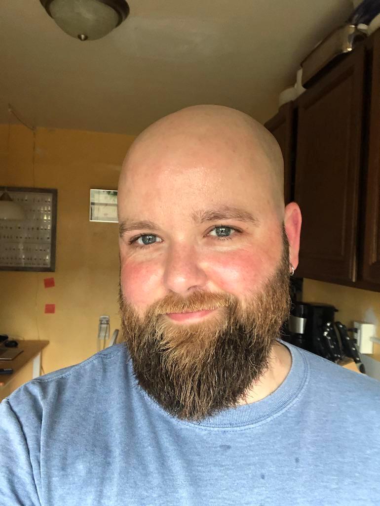 Been rocking a 0 or 1 for over a year; JUST SHAVED the whole thing! I think it works. (33 years ...