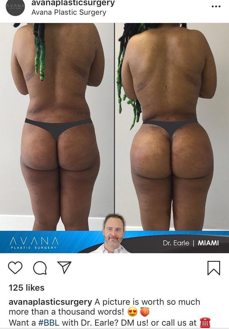 Before and after? | Scrolller