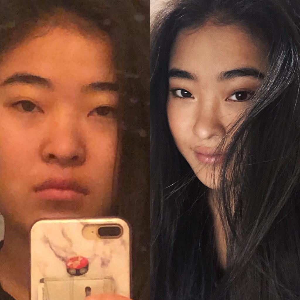 Before and After Hangover | Scrolller