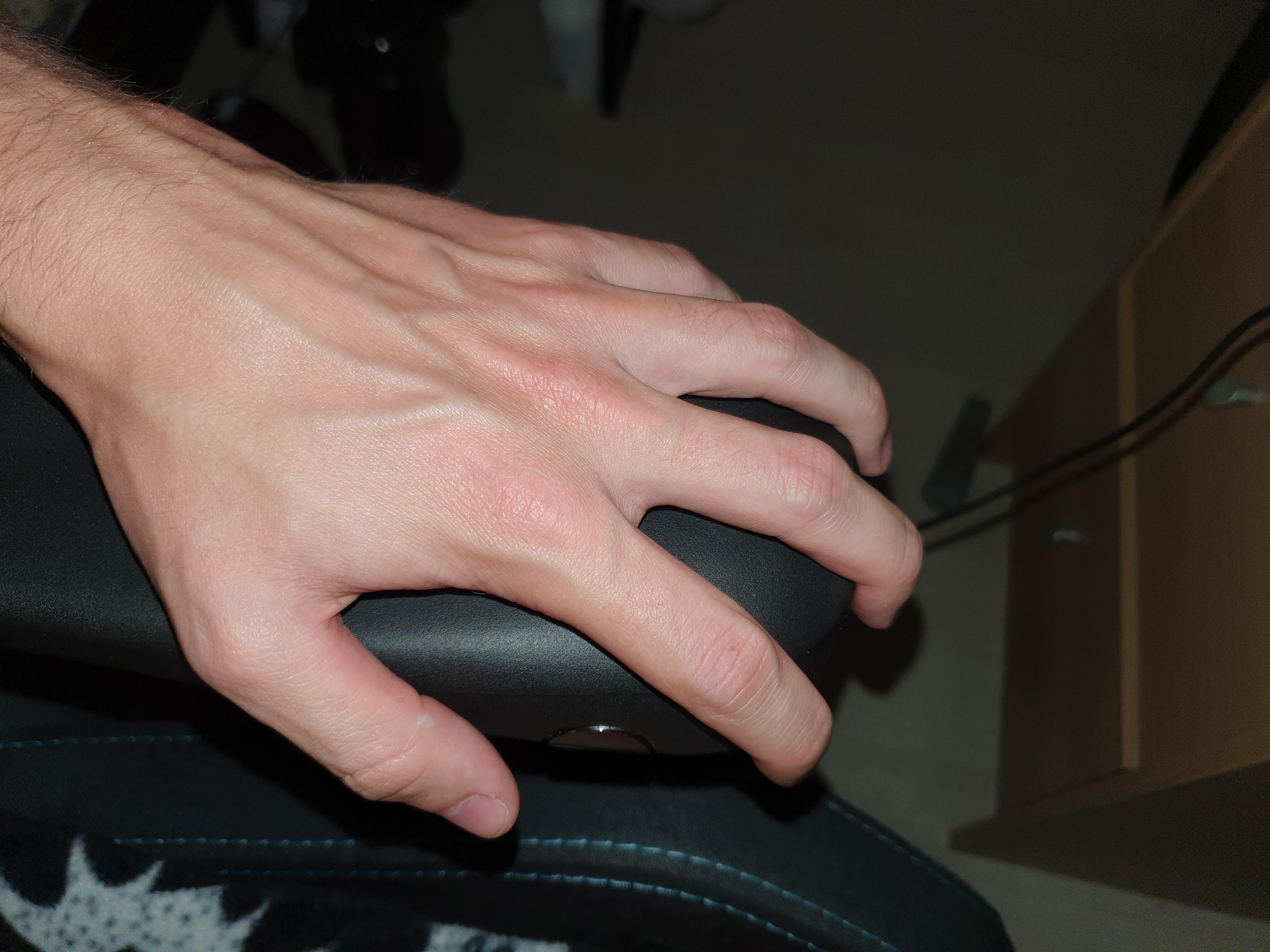 Bit veiny | Scrolller