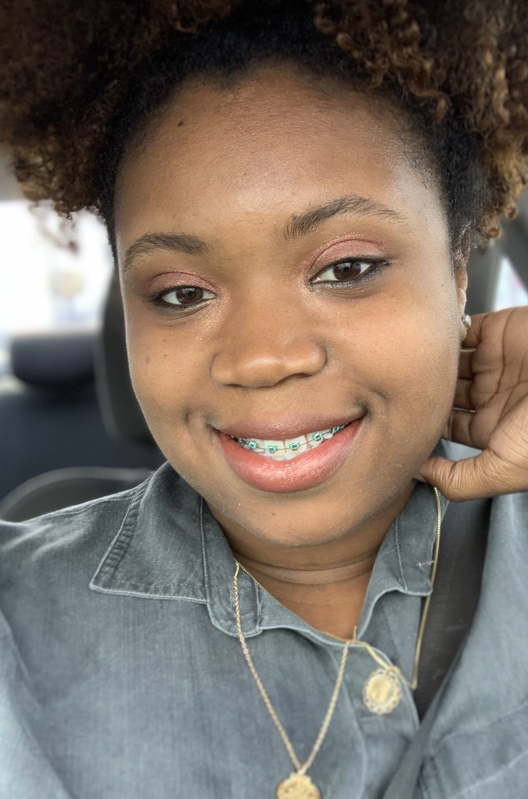 Braces first day experience | Scrolller