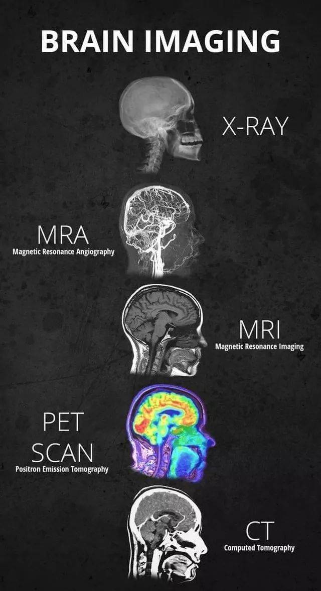 Brain imaging types | Scrolller