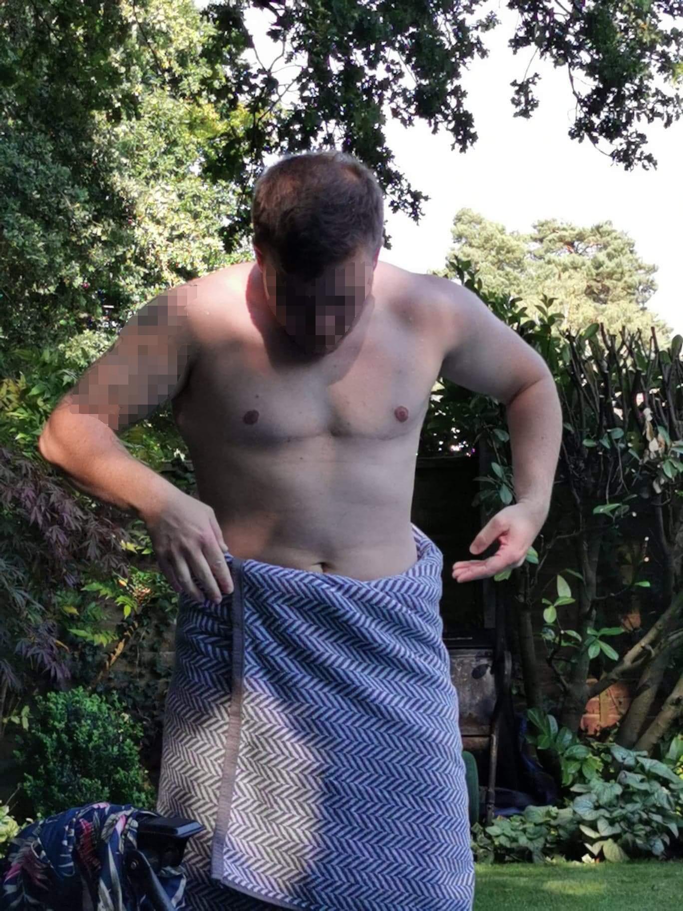 Candid photo of top surgery results. 2.6 years post opp. It's always good to see how your chest ...