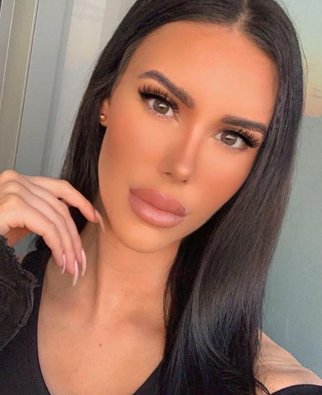 Classy Canadian Brunette with lip fillers | Scrolller