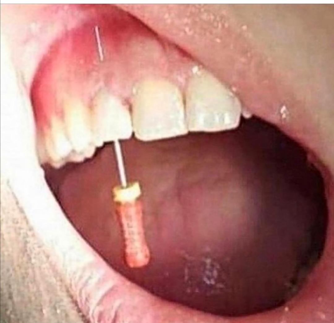 Cursed_needle | Scrolller