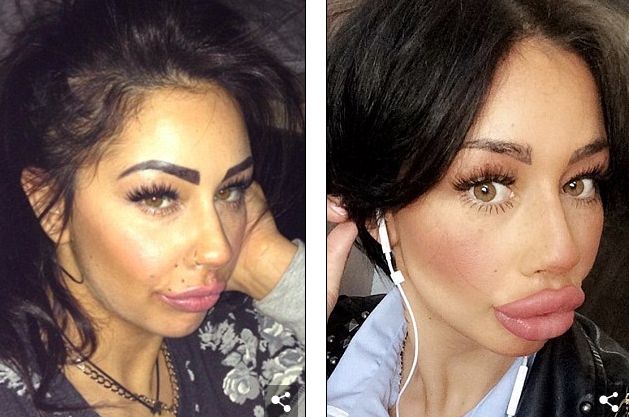 Alia Byrne silicone filled lips | Scrolller