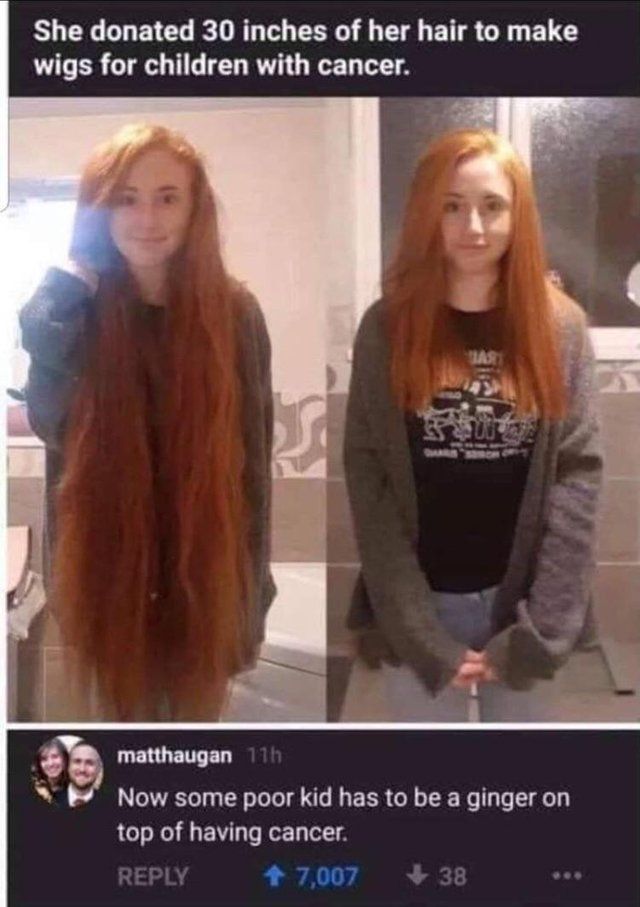 Damn Gingers | Scrolller