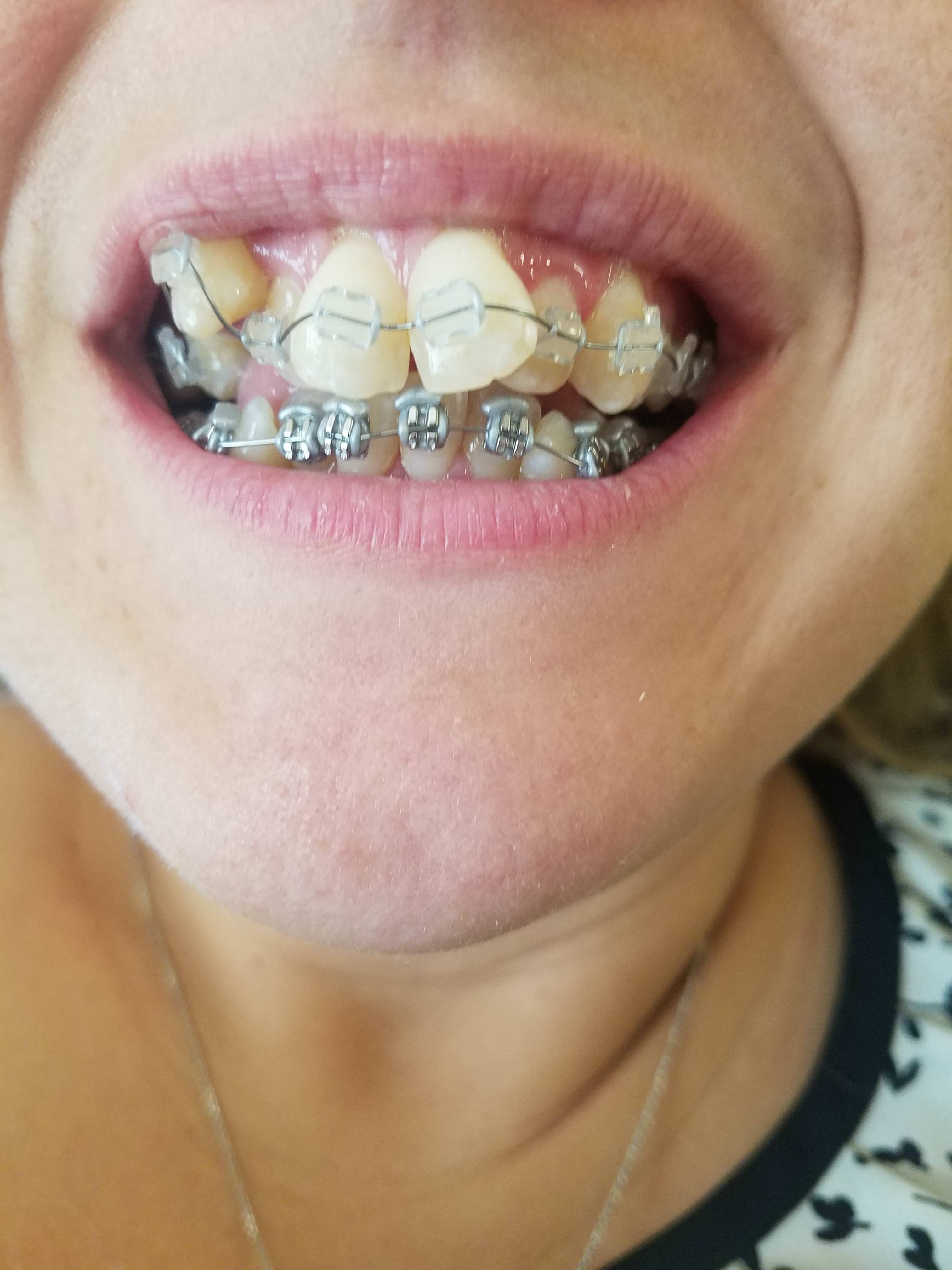 Day 1! Feeling pretty good so far. | Scrolller