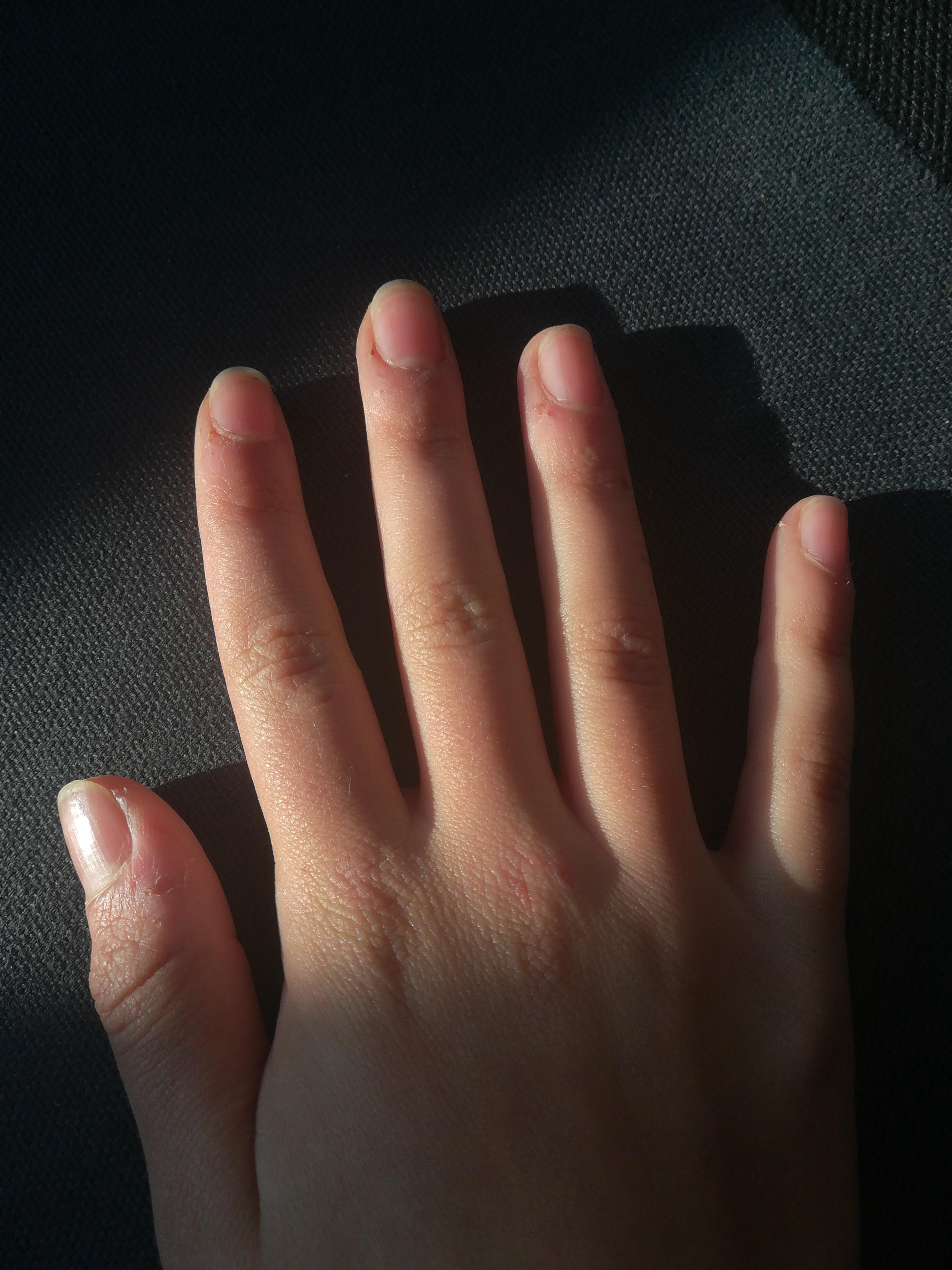 Day 9 :) | Scrolller