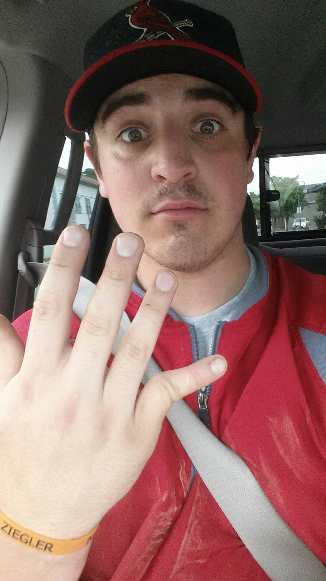 Dislocated my pinky | Scrolller