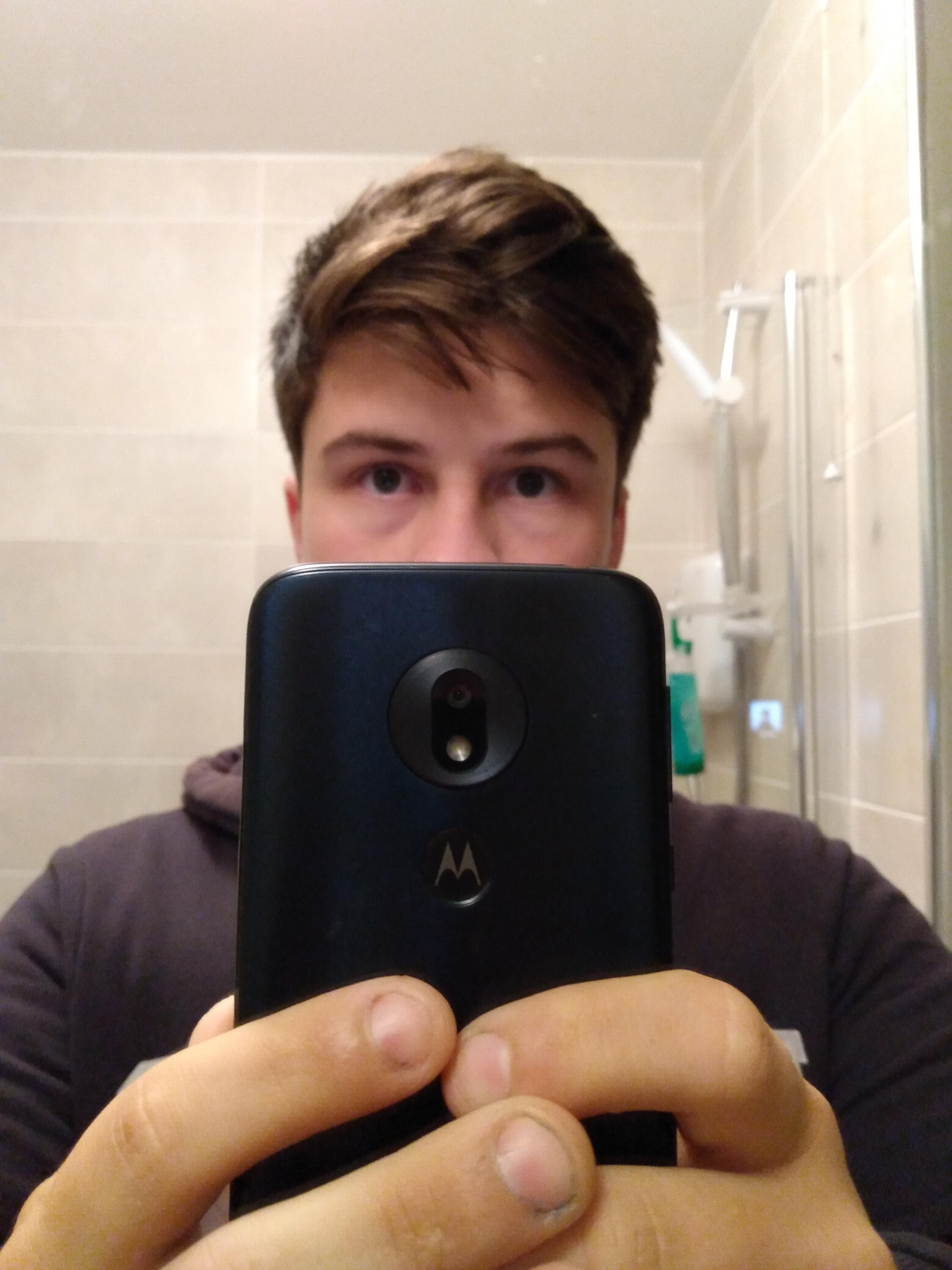 Does anyone know what is causing my permanent bags under my eyes. I'm getting enough sleep. I ...