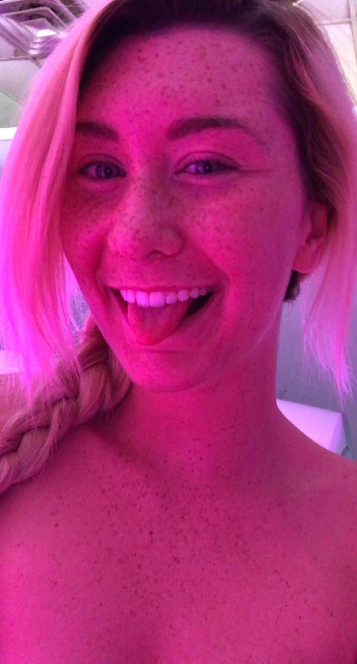 Don’t worry I have enough freckles to go around | Scrolller