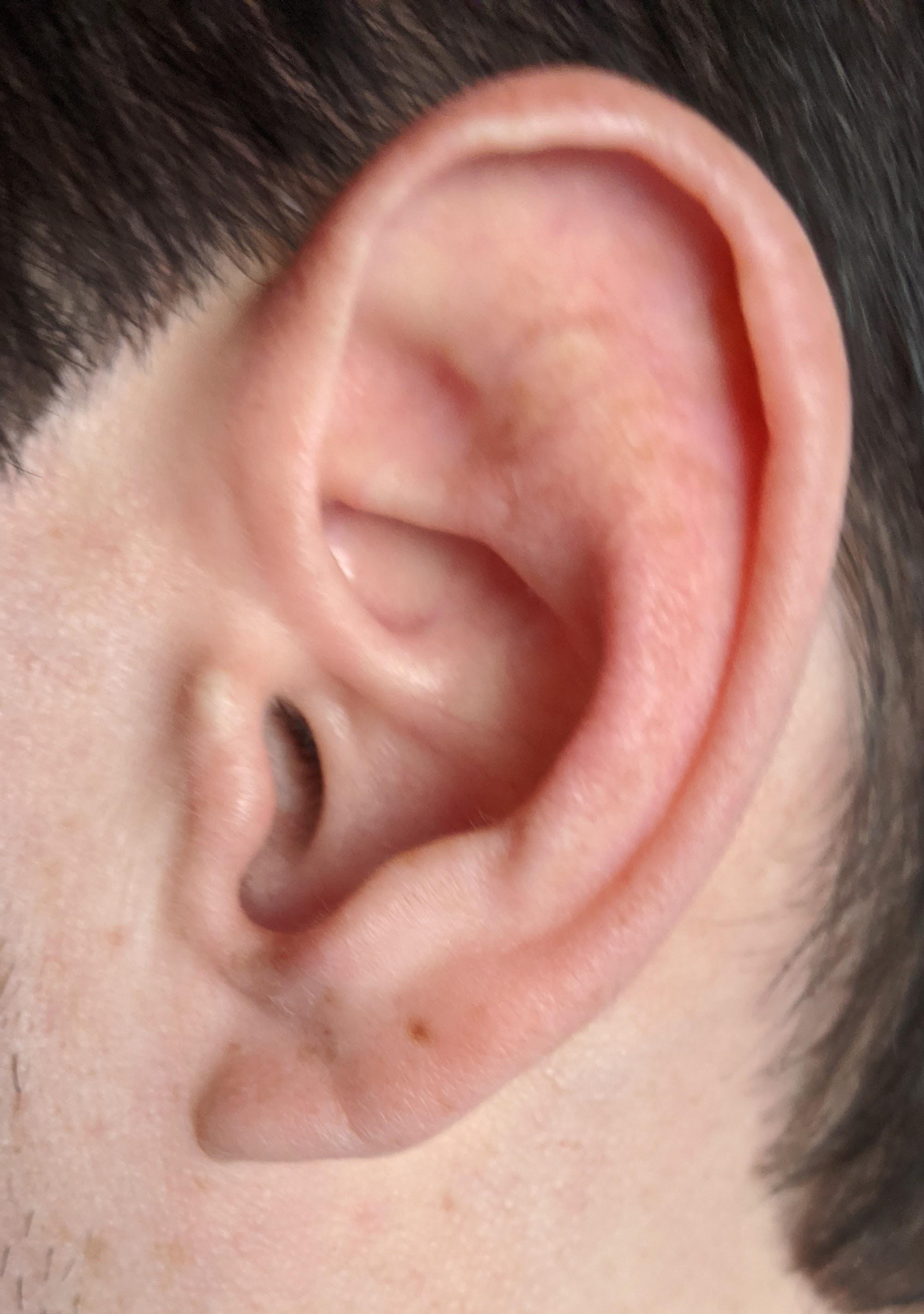 Ear | Scrolller