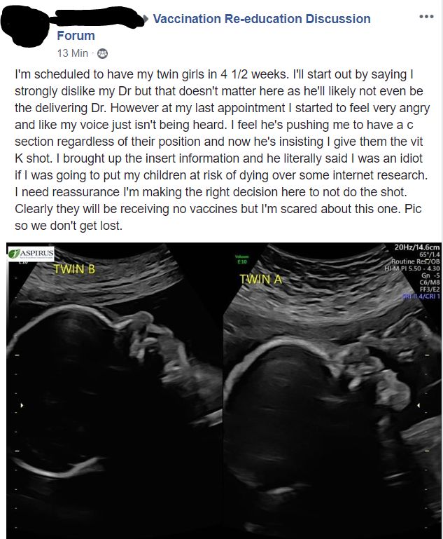 "Encourage me to risk my twins!" | Scrolller