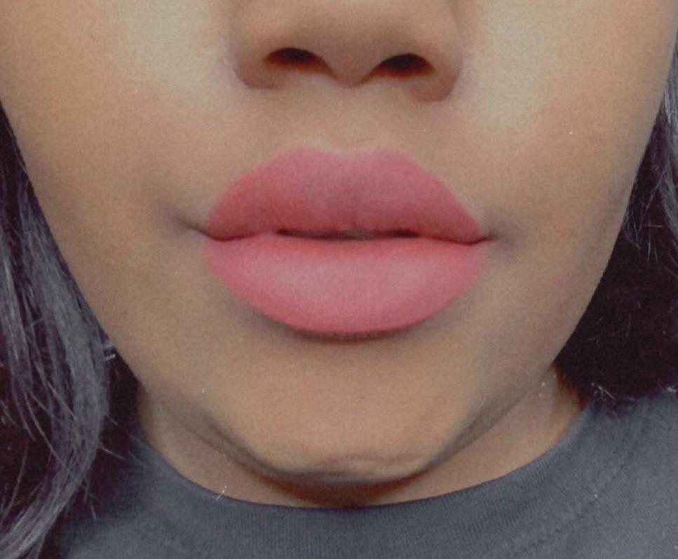 “Exotic” | Scrolller